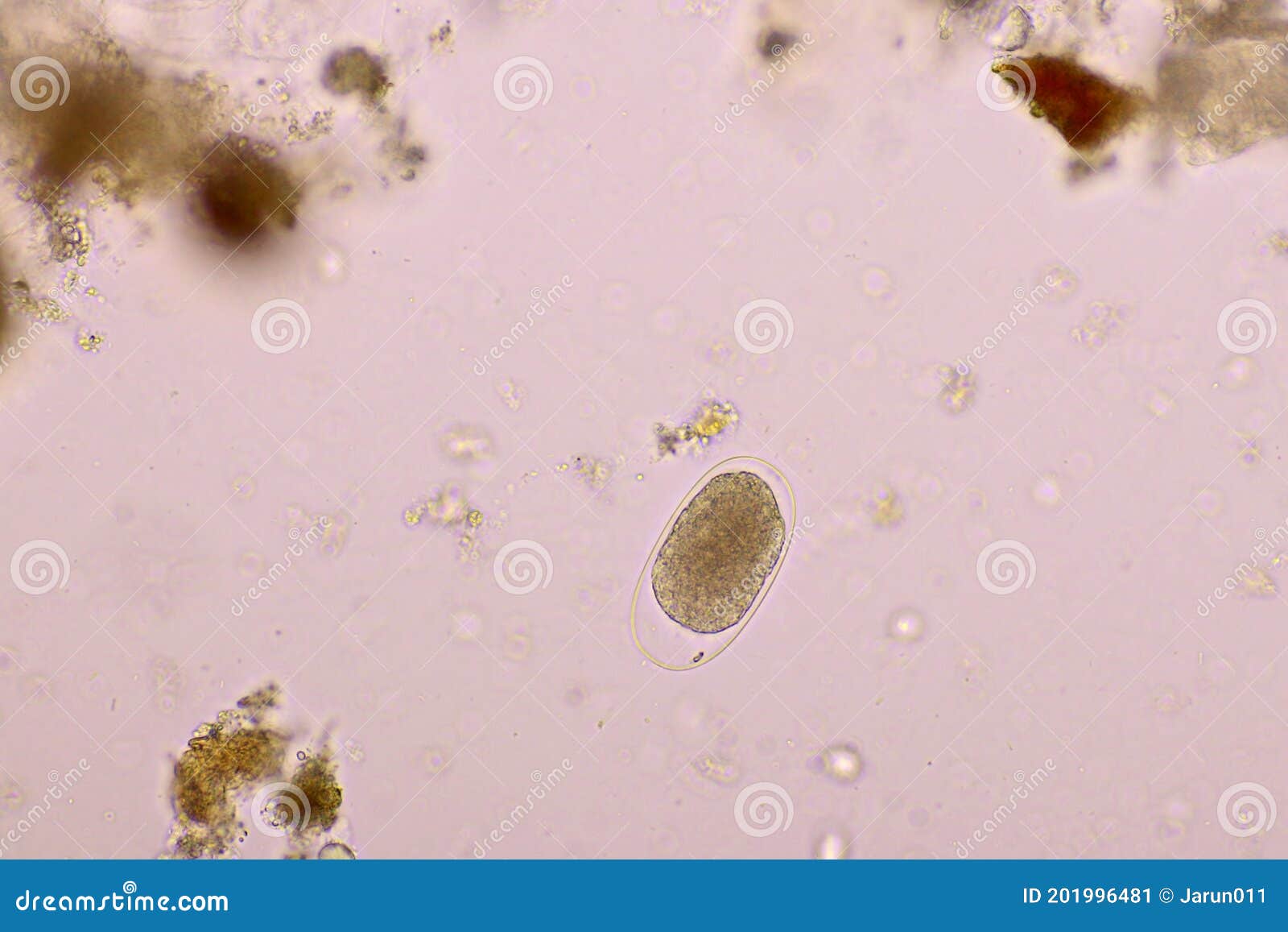 Egg of Hookworm in Human Stool Stock Image - Image of medical, 400x ...