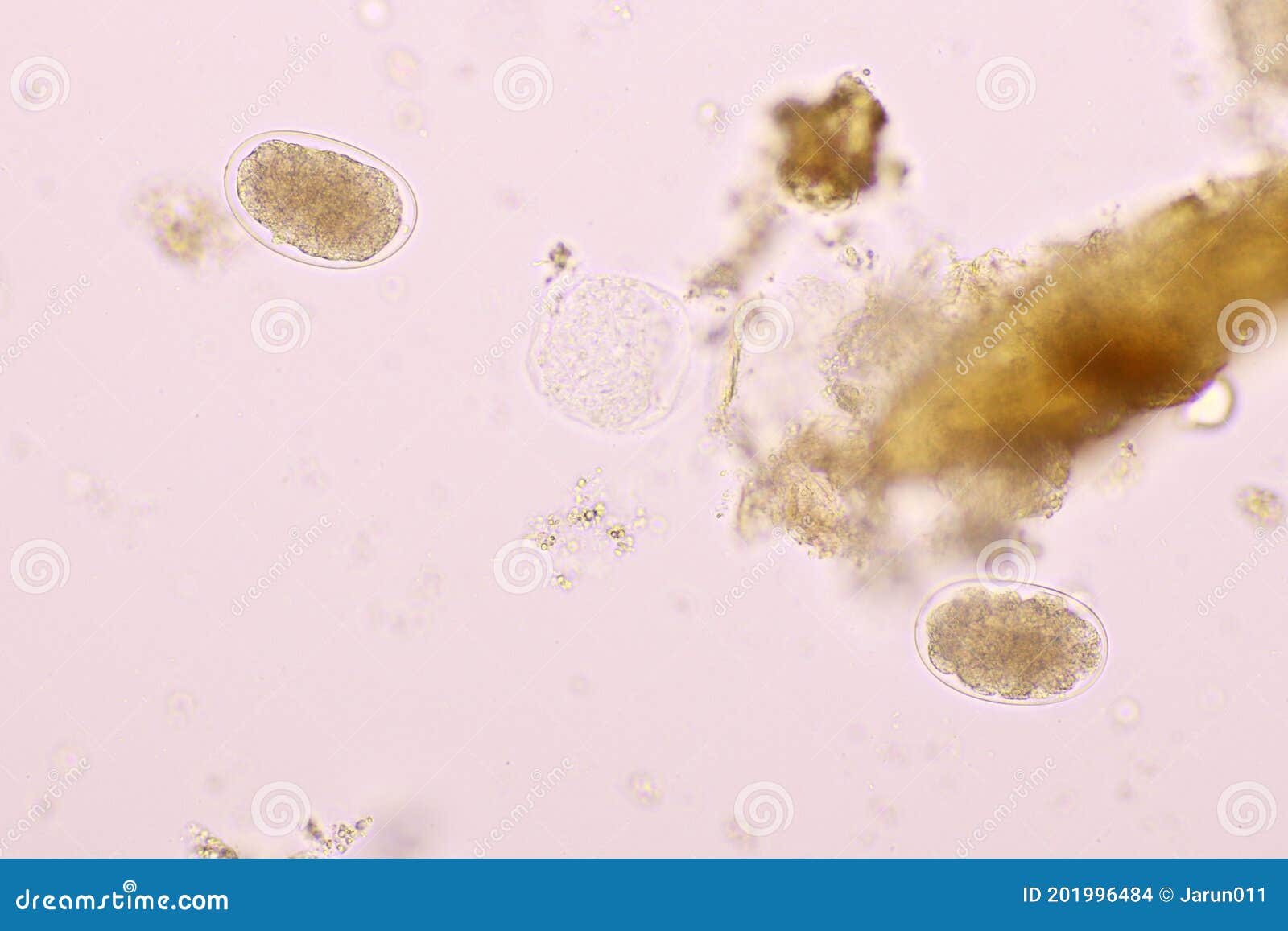 Human Stool Sample Under Microscope Stock Image | CartoonDealer.com ...