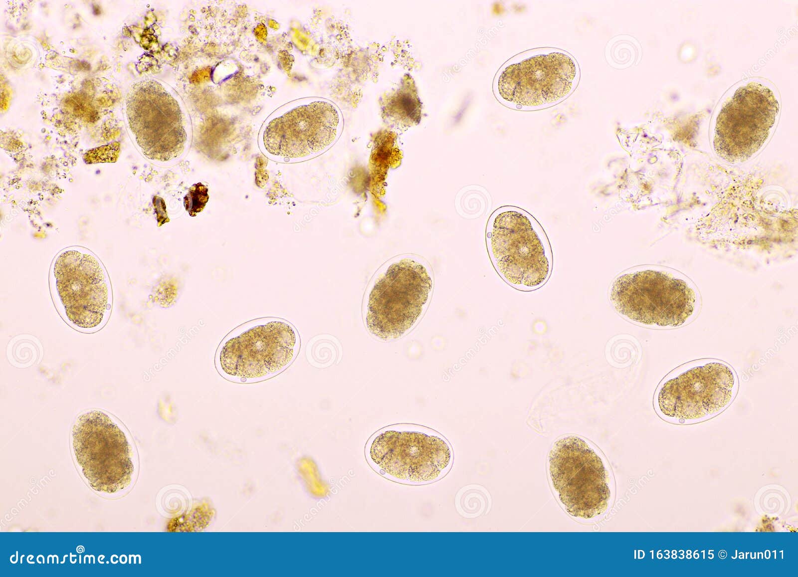 Human Stool Sample Under Microscope Stock Image | CartoonDealer.com ...