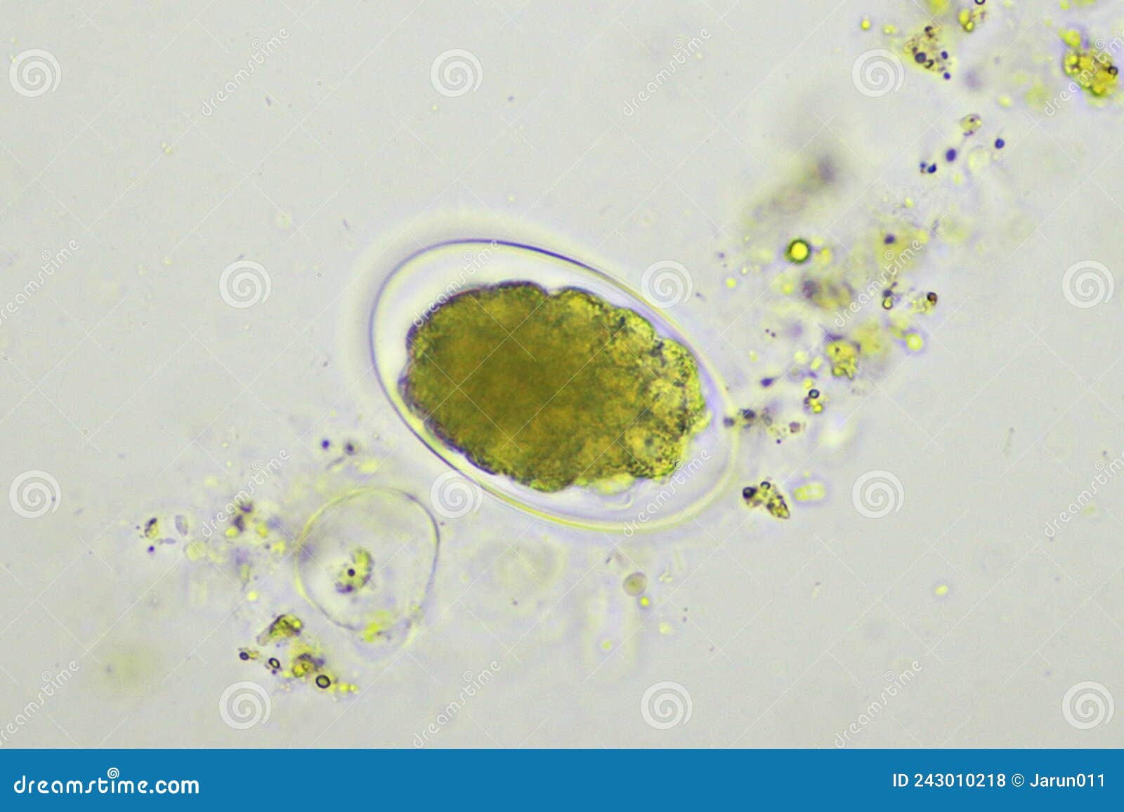 Eggs of Hookworm in Human Stool Stock Photo - Image of fluke ...