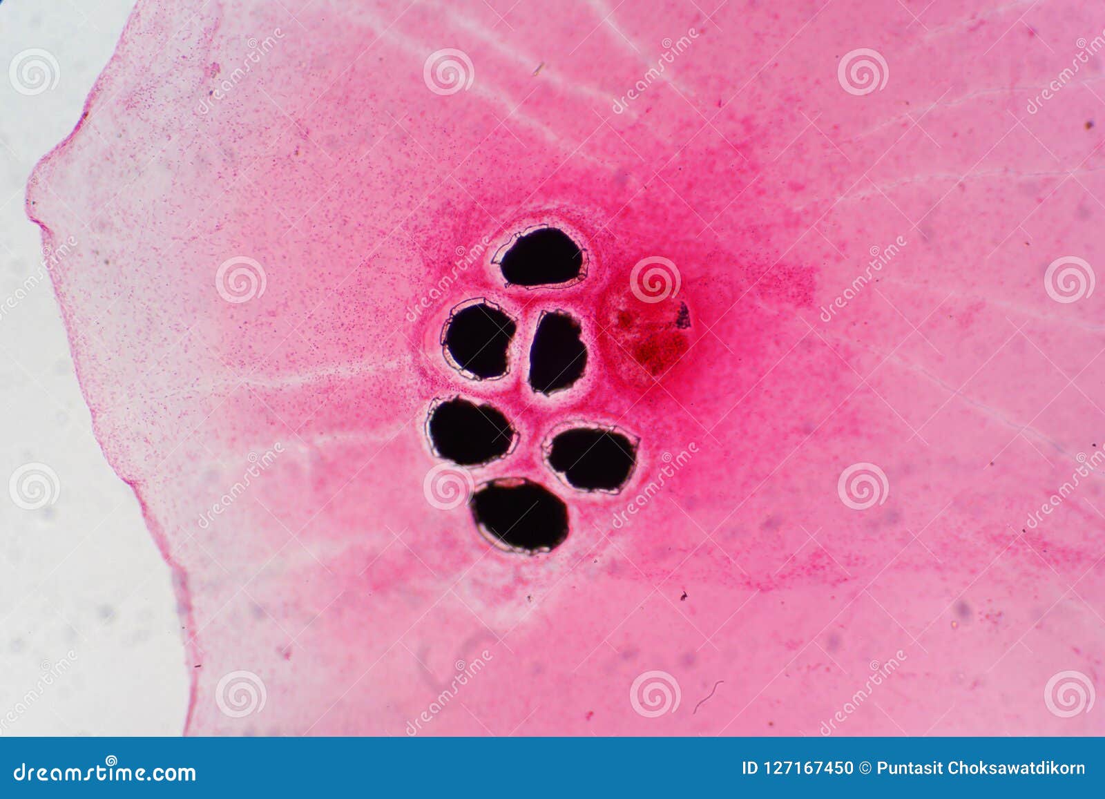 Liver FlukeParasitic Flatworm Of Cattle And Other Grazing Anim Stock ...