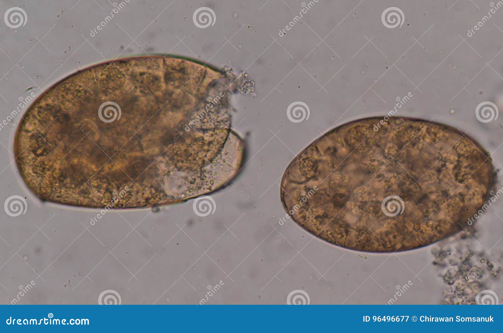 Eggs Parasite Stock Photography | CartoonDealer.com #90764924