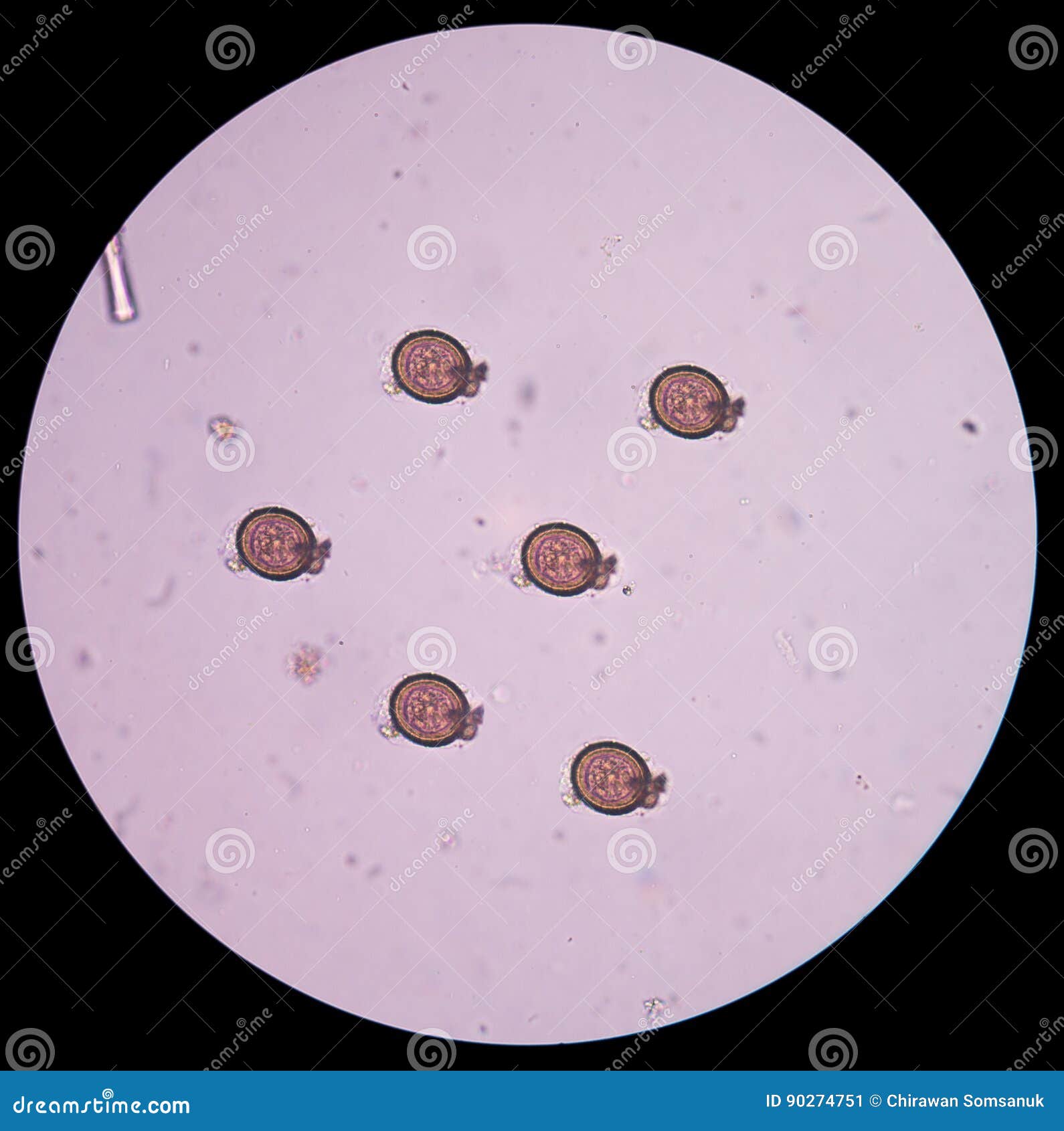 Eggs of parasite stock image. Image of water, medical - 90274751