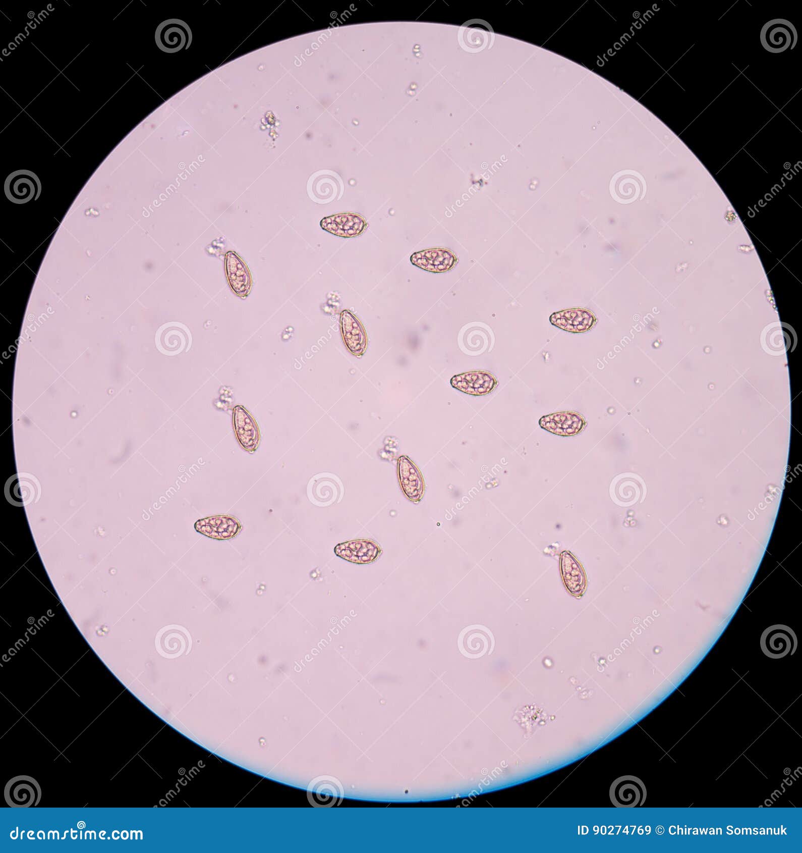 Eggs of parasite stock image. Image of medical, tapeworm - 90274769