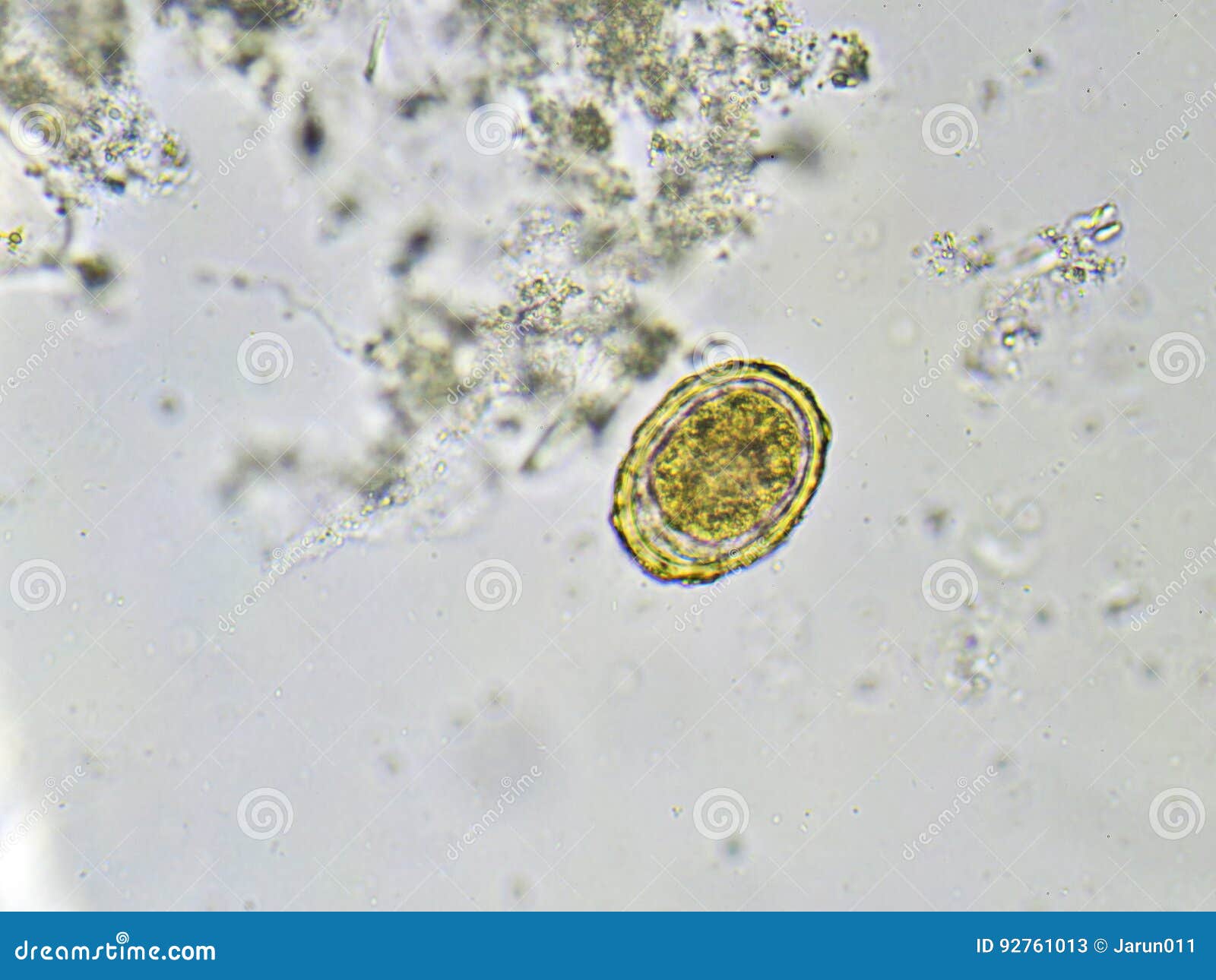 Ei Von Ascarid Lumbricoides Spulwurm Stockbild - Bild von prüfung ...