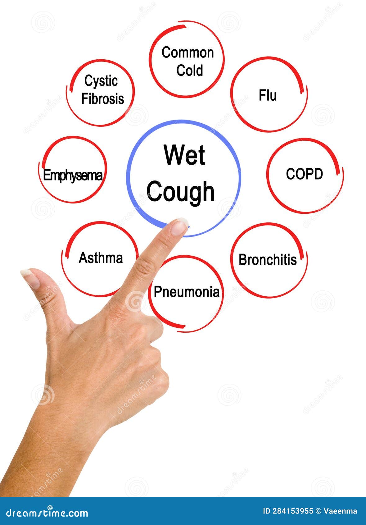 Causes of Wet Cough stock image. Image of cough, disease - 284153955