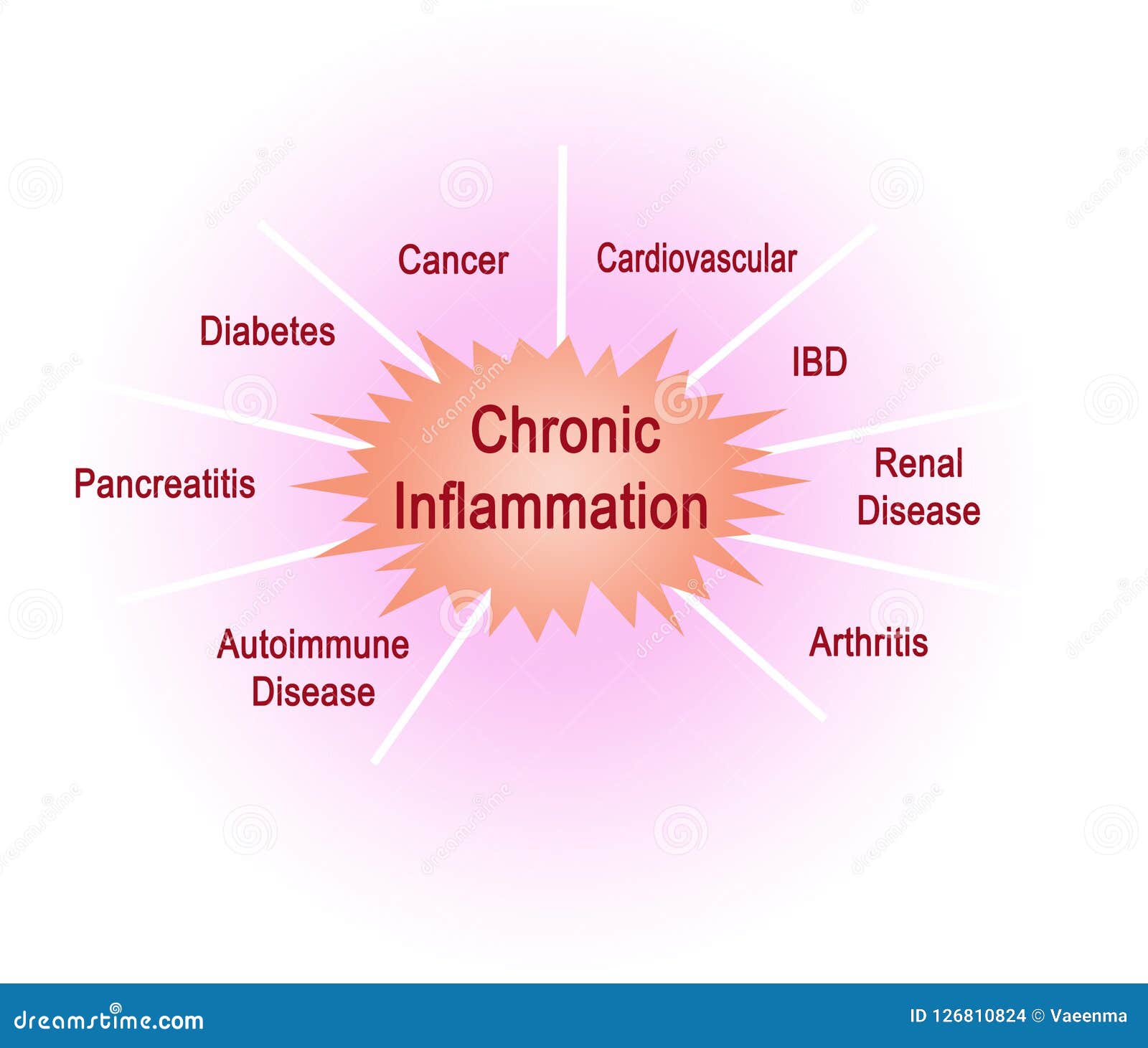 Consequences Of Chronic Inflammation Stock Photography | CartoonDealer ...