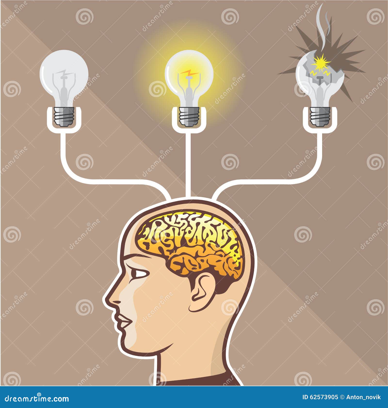 Ejemplo Bien Escogido De La Mente Del Vector De La Idea Correcta ...