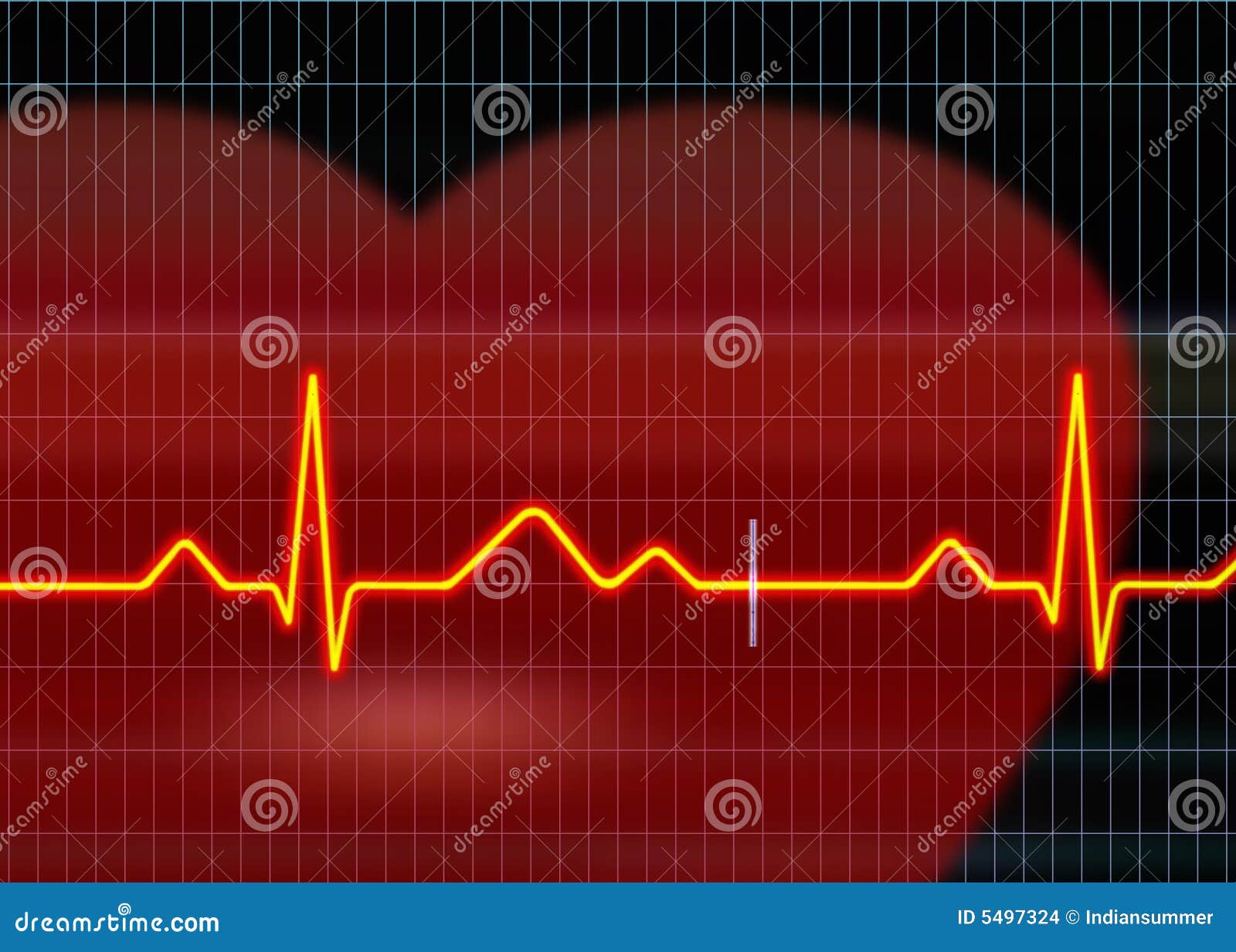 Ejemplo Del Cardiograma Imagen. Imagen: 5497324
