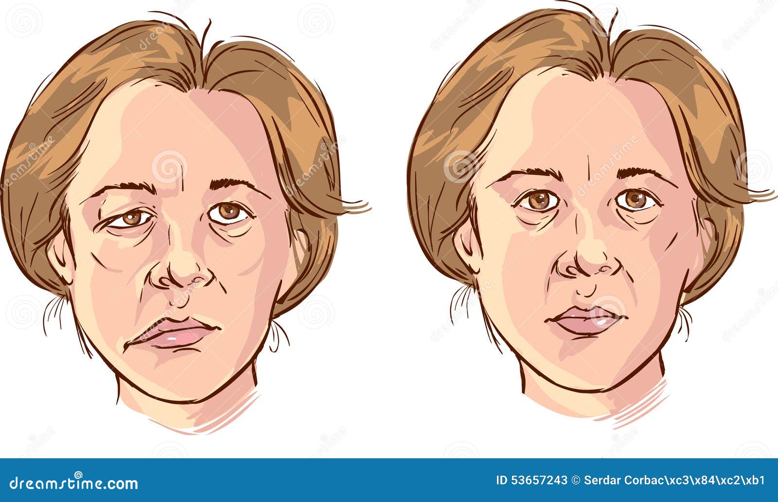 Ejemplo ladeado facial ilustración del vector. Ilustración de facial ...