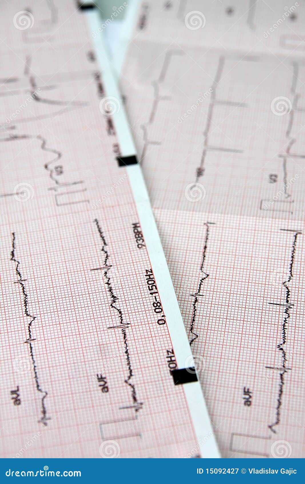 Ekg stock image. Image of examining, imaging, treatment - 15092427