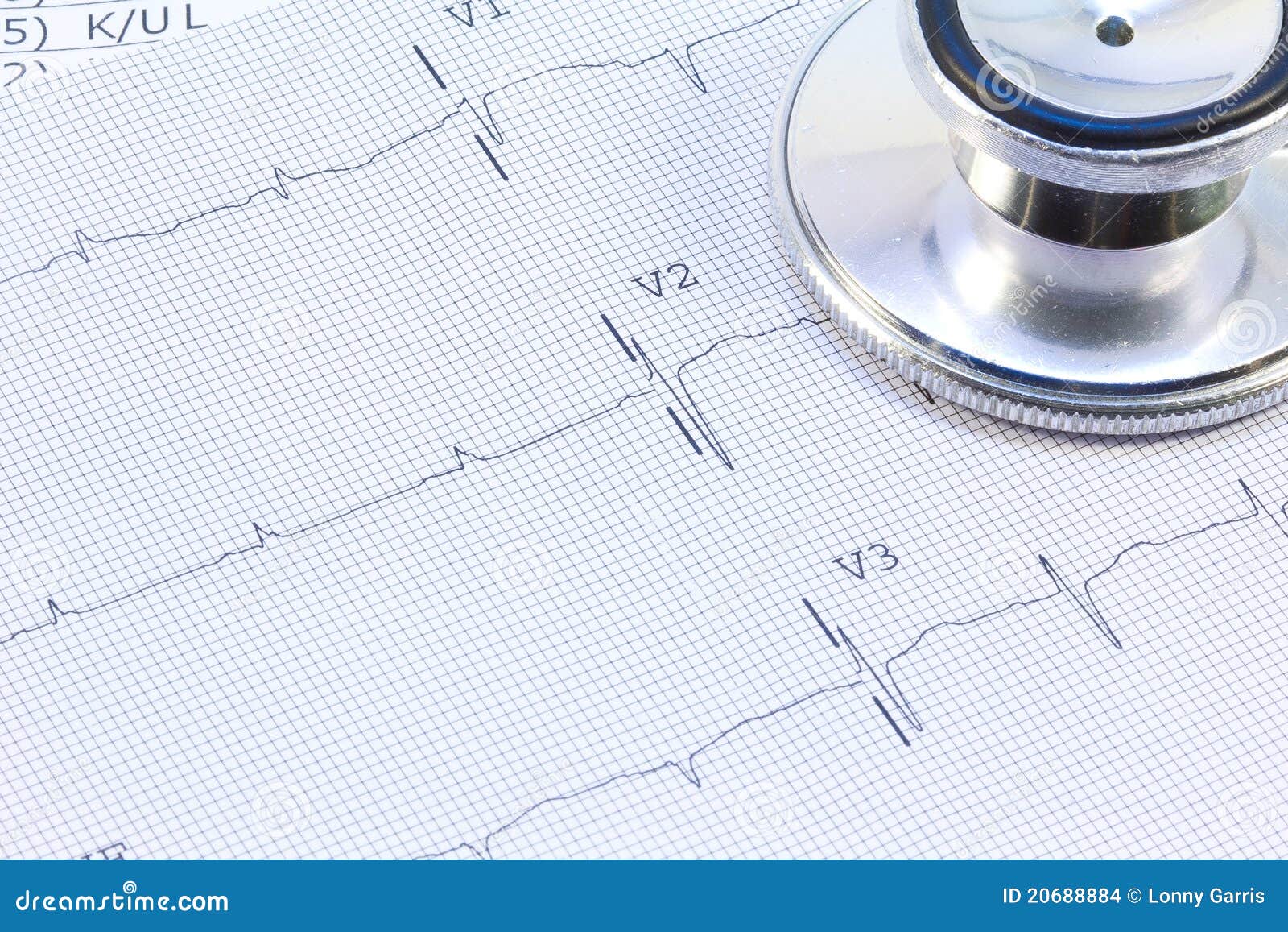 EKG stock photo. Image of medical, wave, stethoscope - 20688884