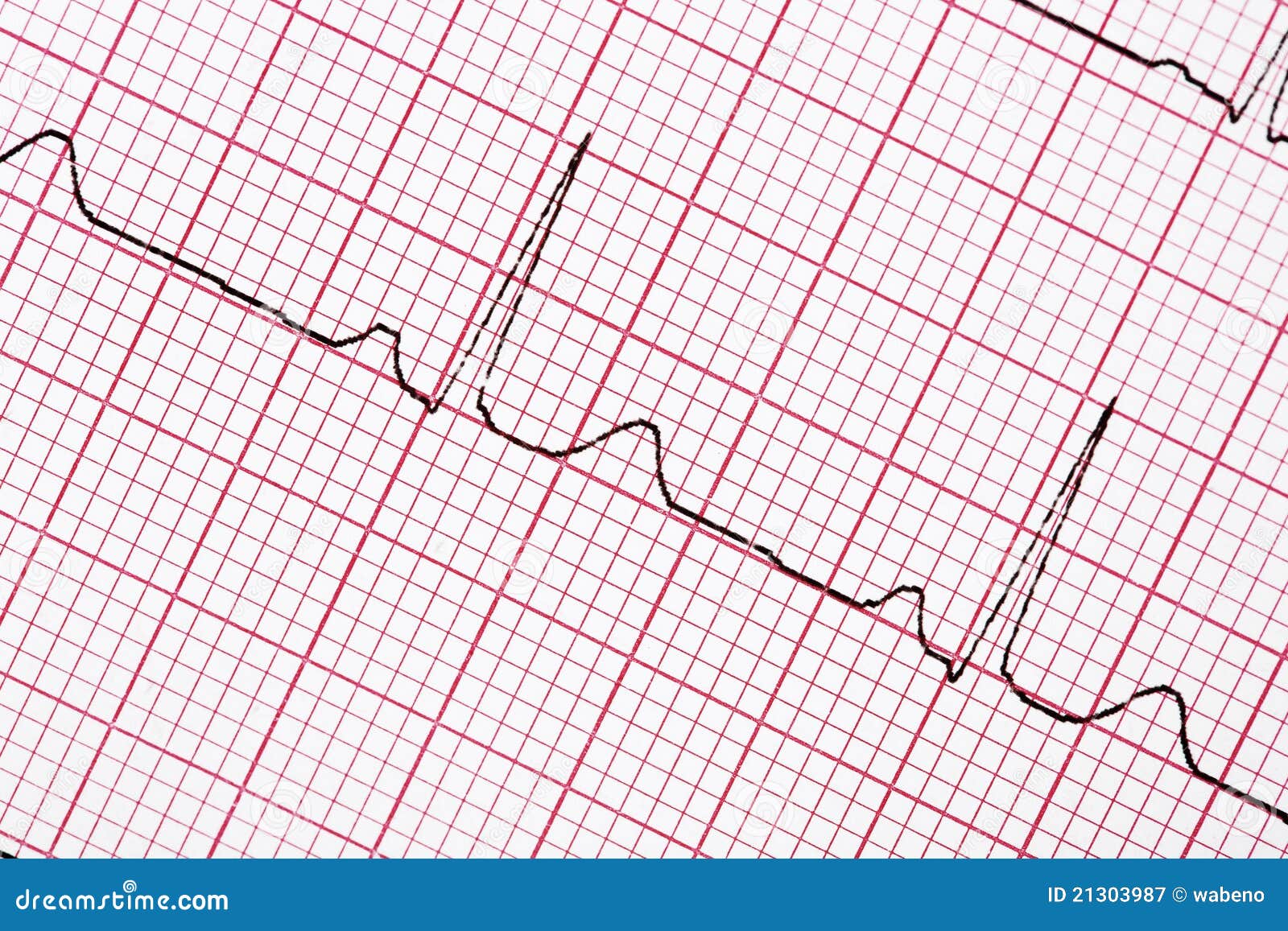 EKG stock image. Image of chart, illness, printout, scrutiny - 21303987