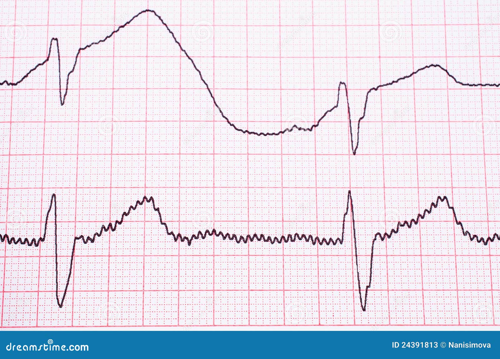 EKG stock image. Image of electrocardiogram, heartbeat - 24391813