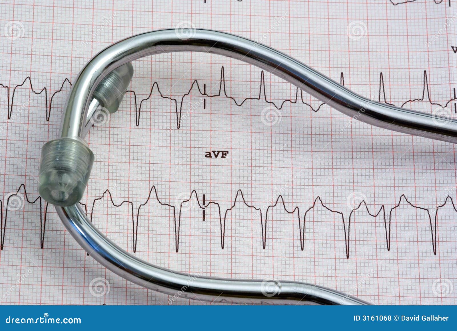 EKG stock photo. Image of examine, graph, analyzing, emergency - 3161068