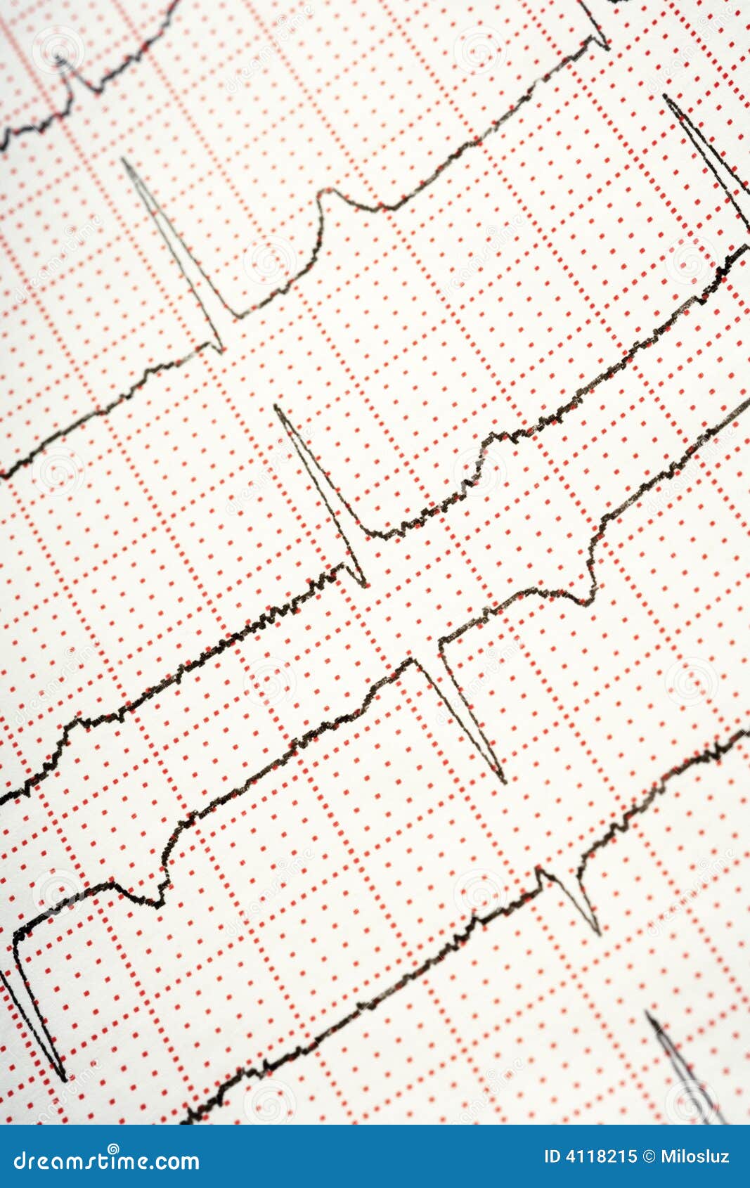 EKG stock image. Image of condition, health, heart, checkup - 4118215