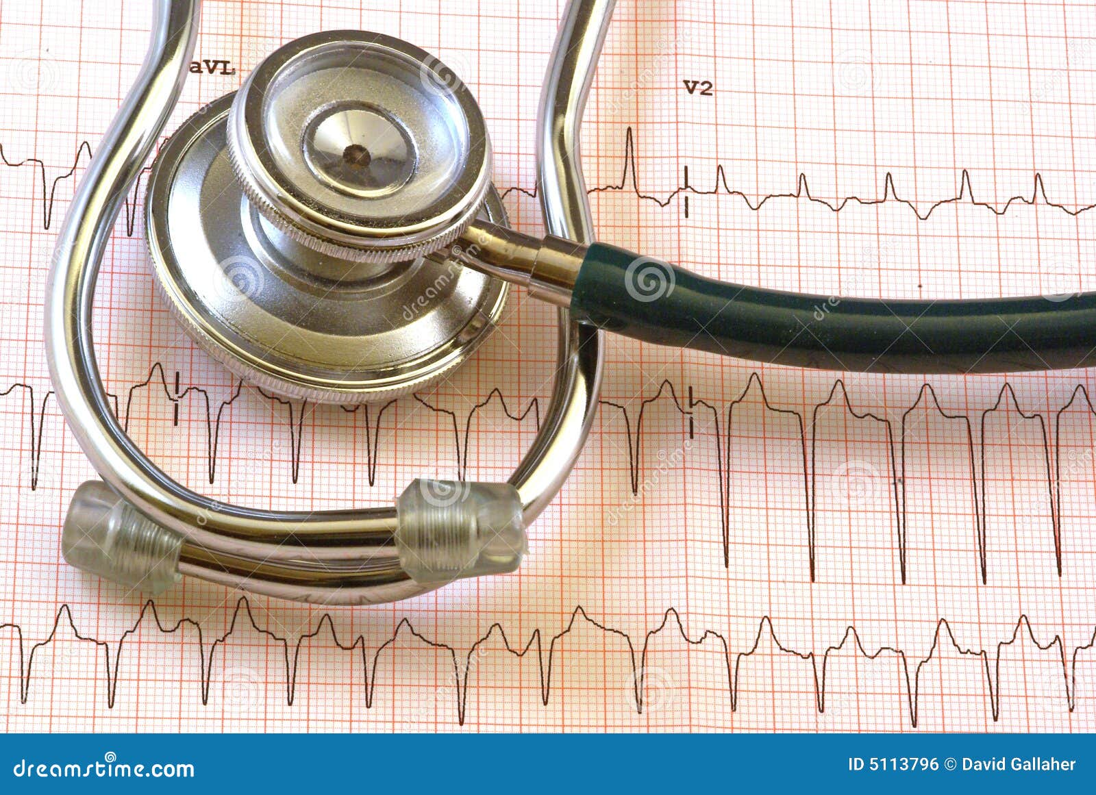 Ekg stock photo. Image of doctor, ambulance, clinic, electrocardiogram ...