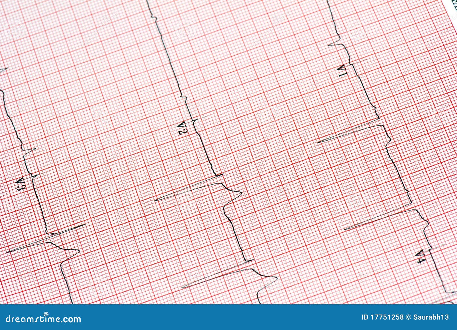EKG background stock photo. Image of health, graphic - 17751258