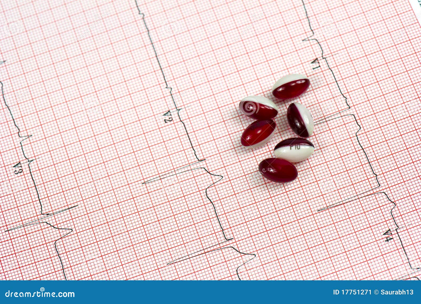 EKG background stock image. Image of electrocardiogram - 17751271