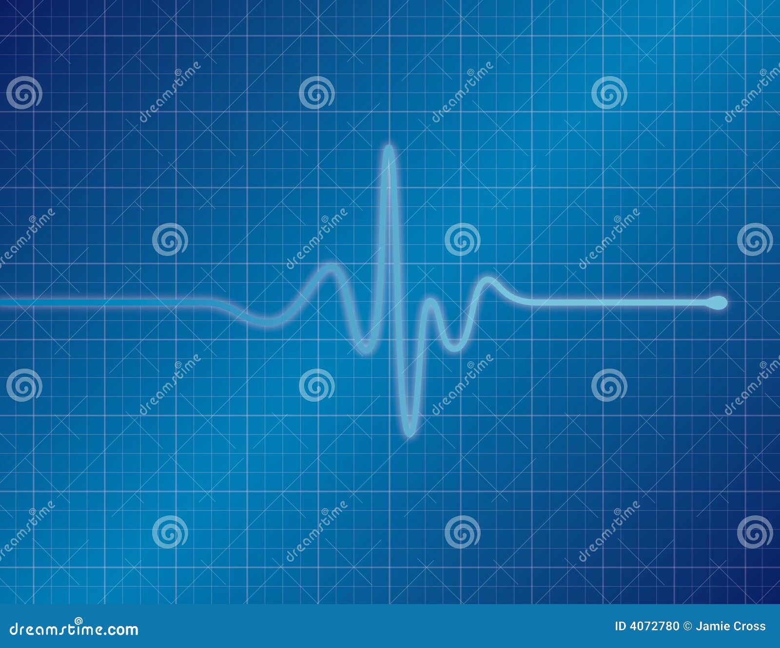 EKG - Blue stock vector. Illustration of graph, vitality - 4072780
