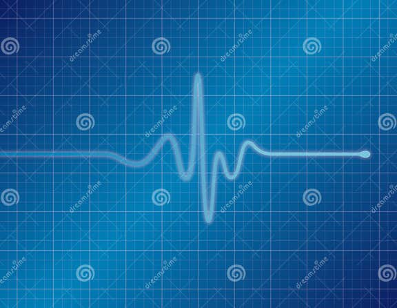 EKG - Blue stock vector. Illustration of graph, vitality - 4072780
