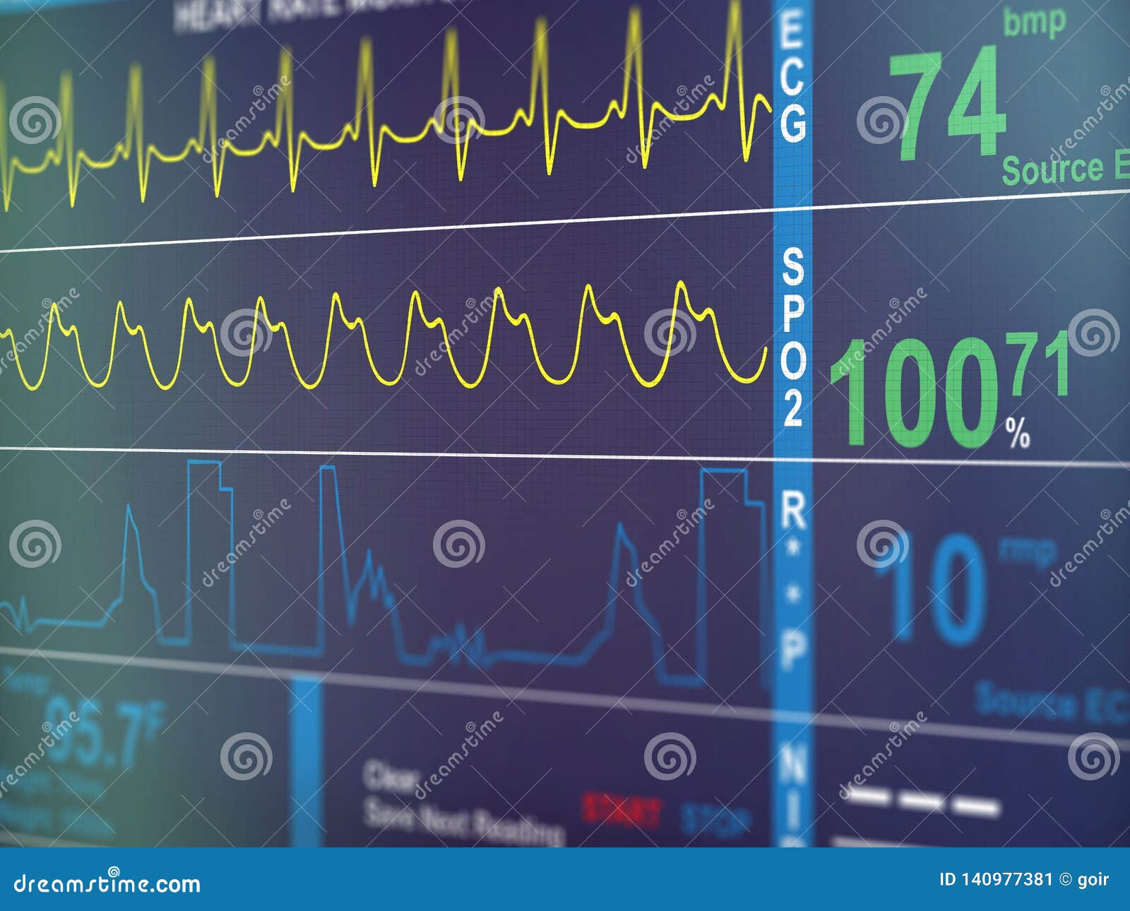 EKG cardiogram closeup stock illustration. Illustration of graphic ...