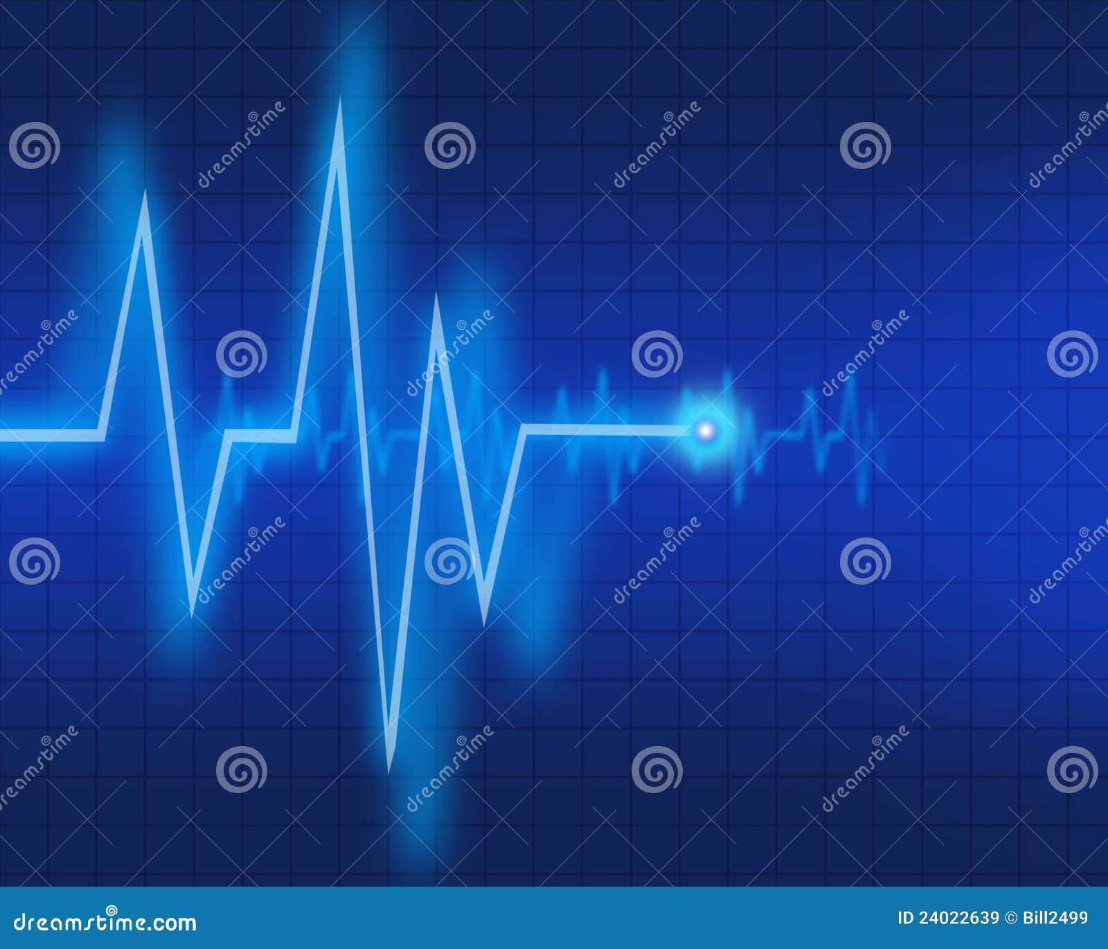 EKG chart stock illustration. Illustration of medical - 24022639