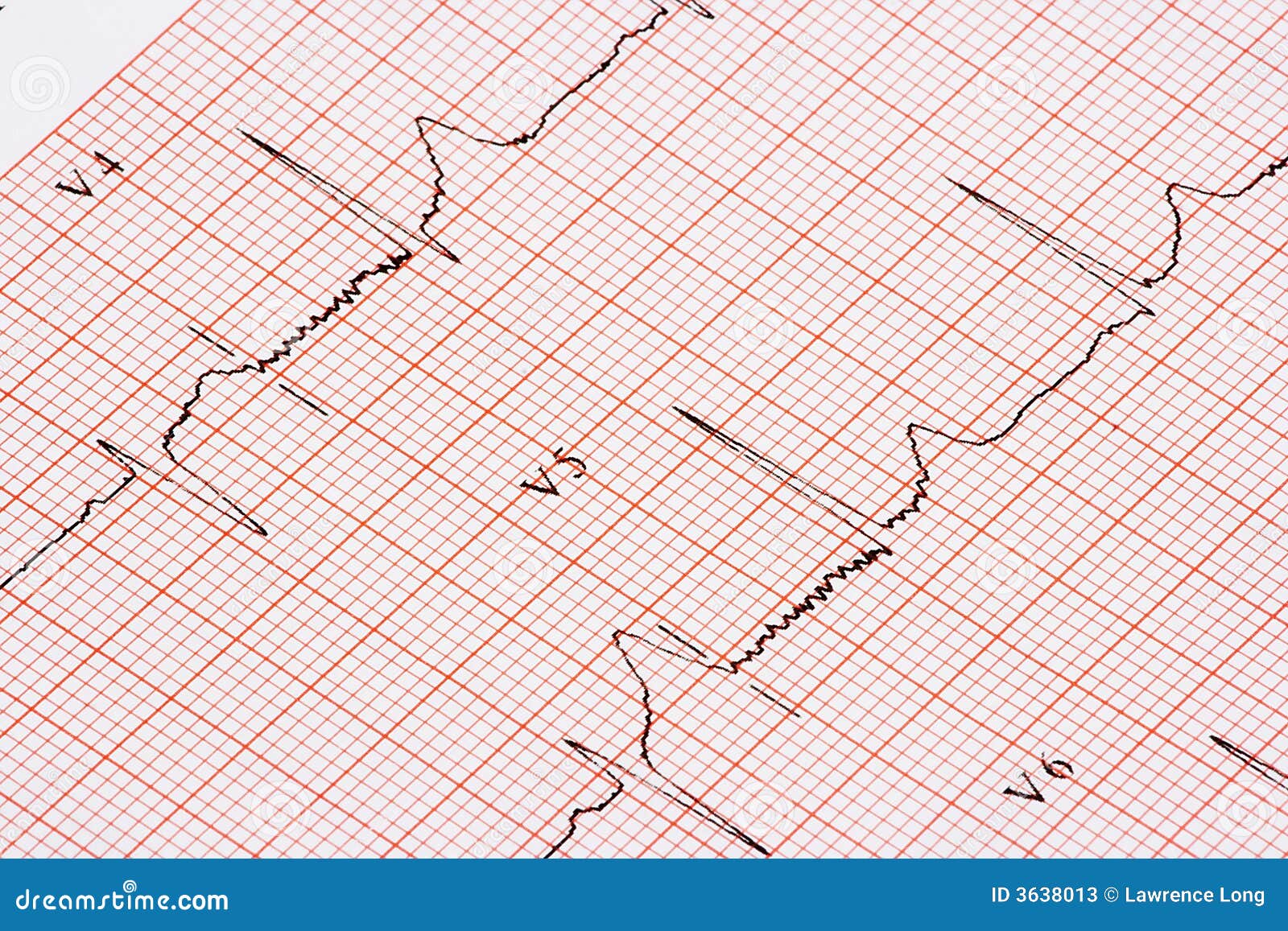 EKG chart stock image. Image of heart, digital, signal - 3638013