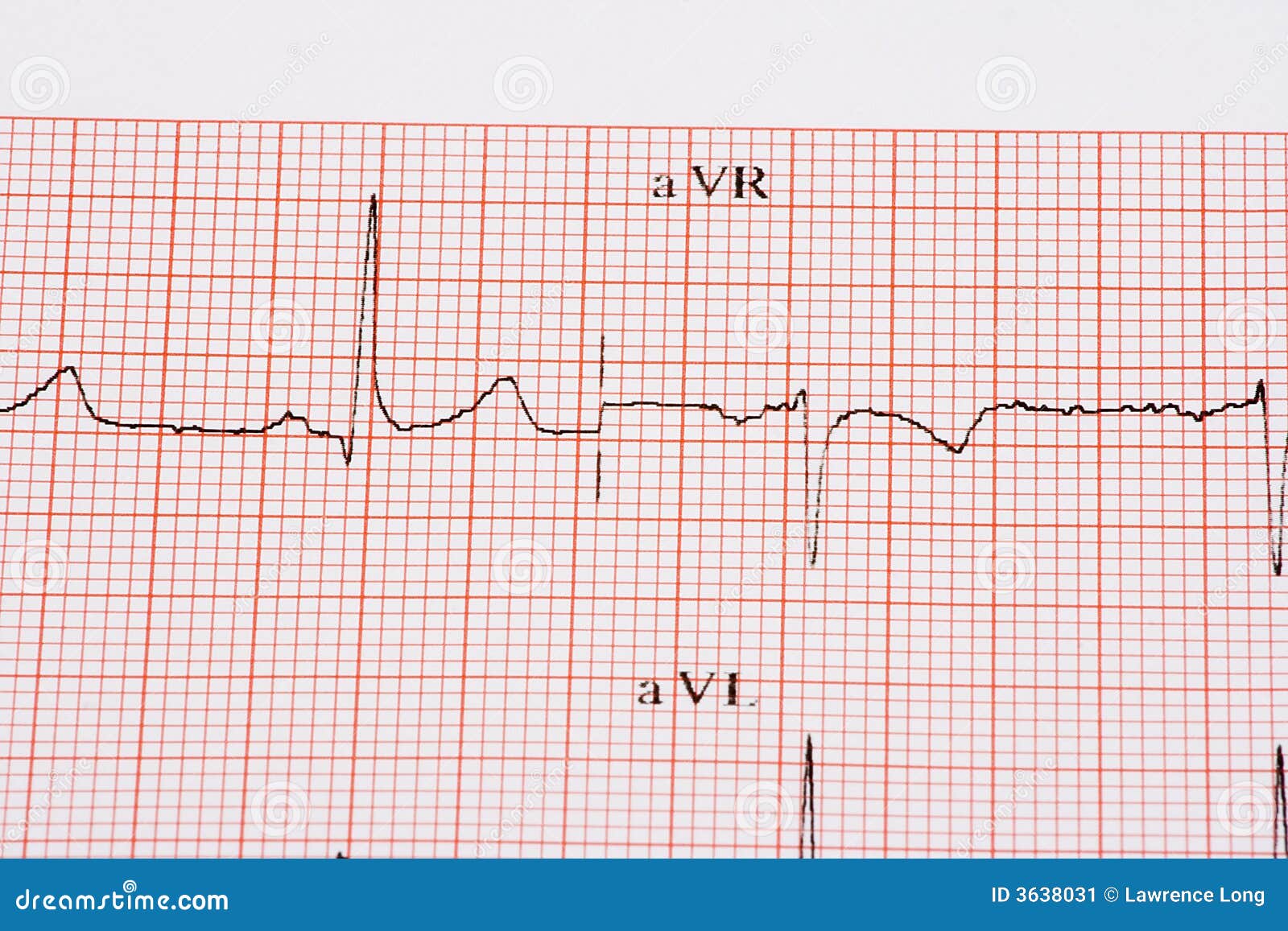 EKG chart stock image. Image of printout, electrocardiogram - 3638031