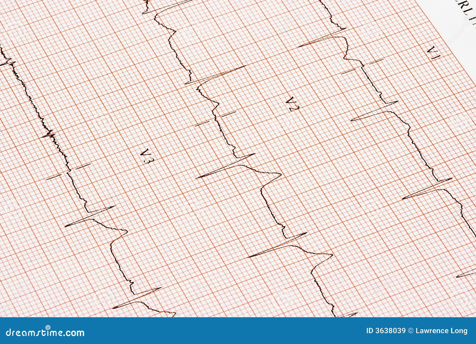 EKG Chart Picture. Image: 3638039