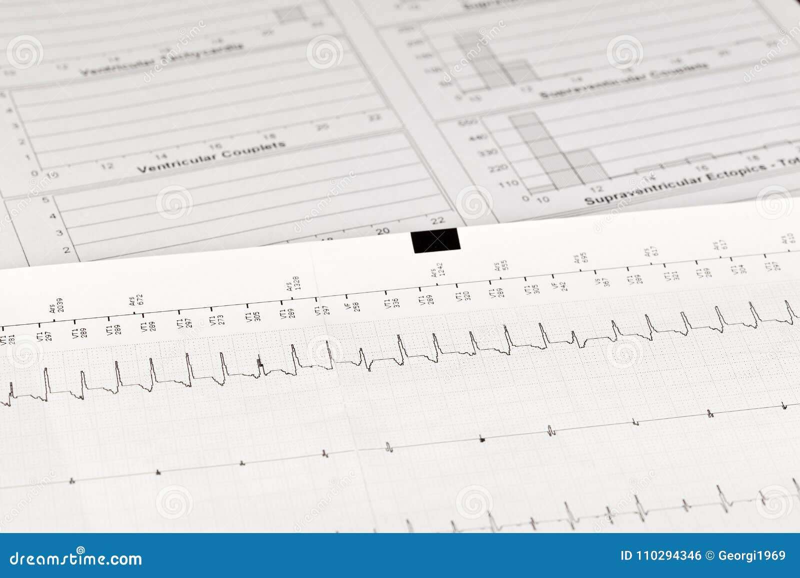 EKG chart on paper stock photo. Image of chart, exam - 110294346