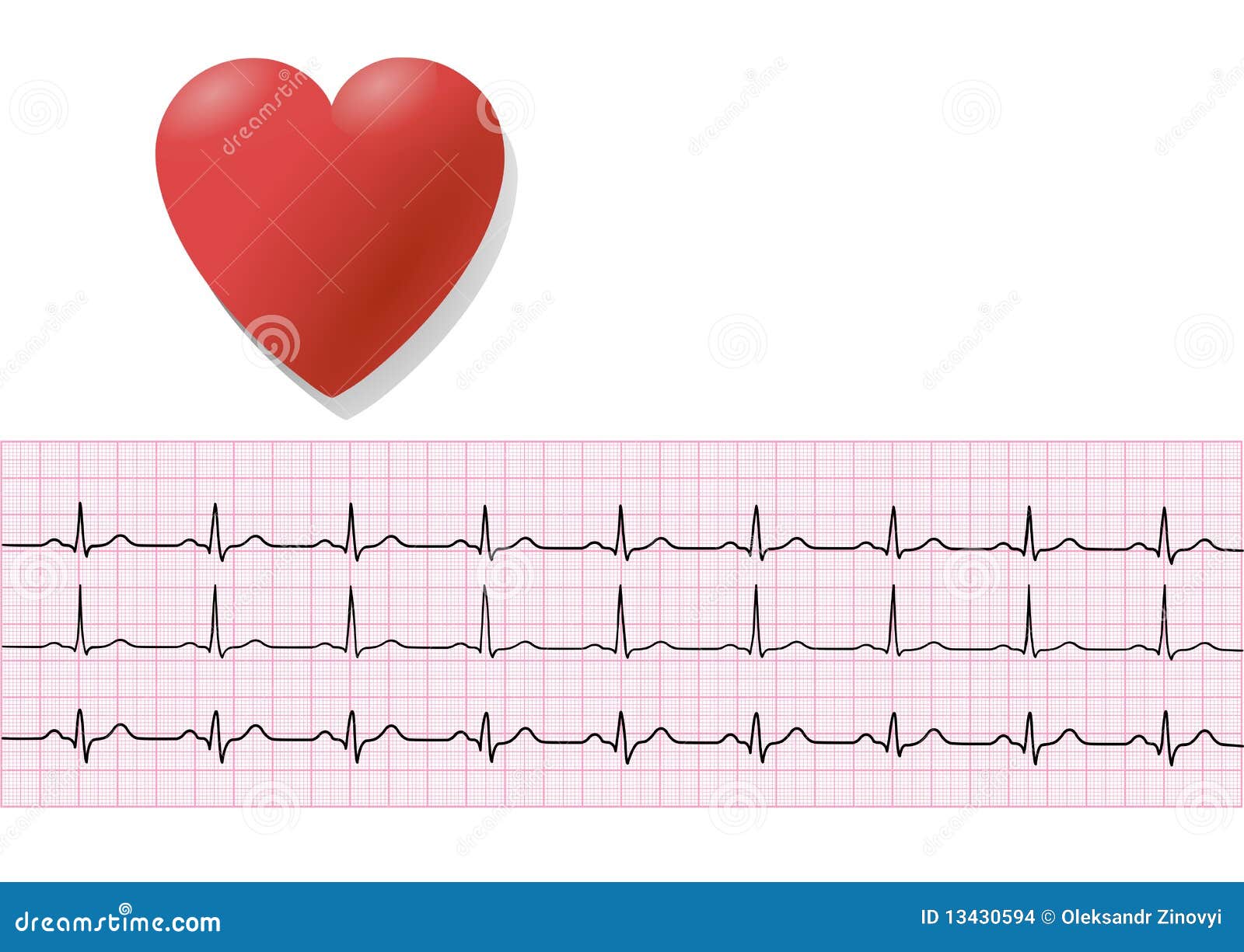 EKG/ ECG 3 stock vector. Illustration of electrocardiogram - 13430594