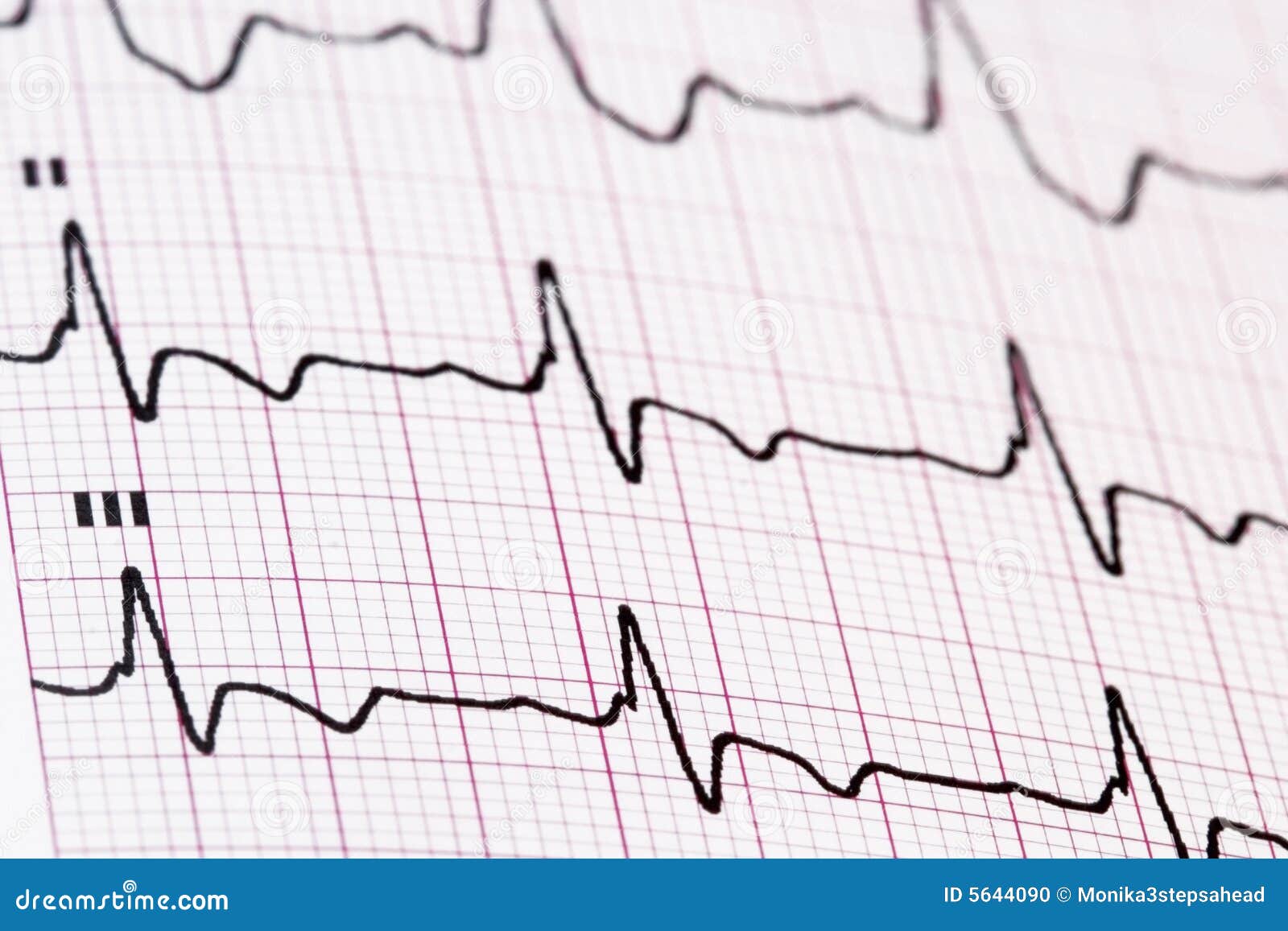 Ekg/ ecg as a background stock photo. Image of activity - 5644090