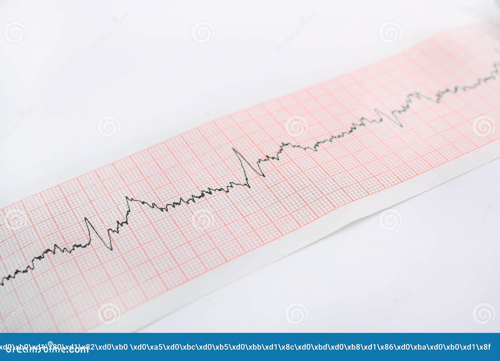 EKG or ECG Graph. Electrocardiogram Examination. Close Up Stock Image ...