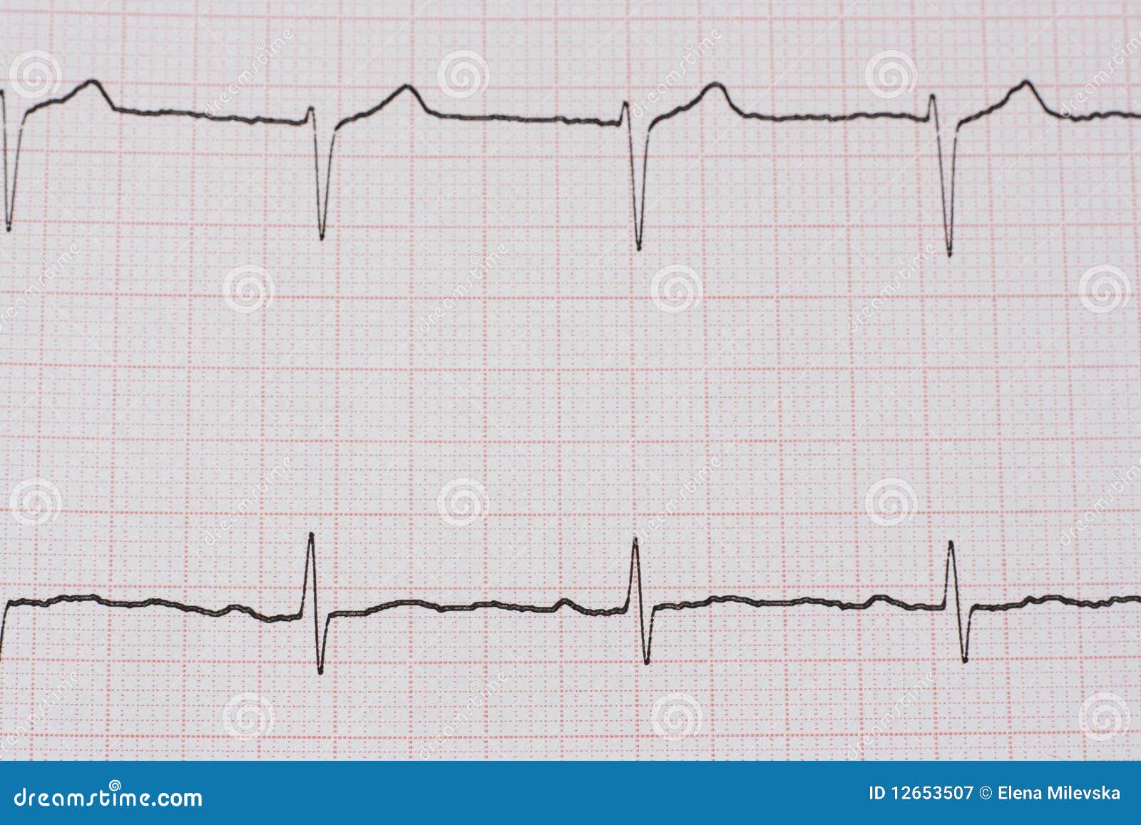 Ekg/ Ecg - Medical Background Stock Image - Image of health, heart ...