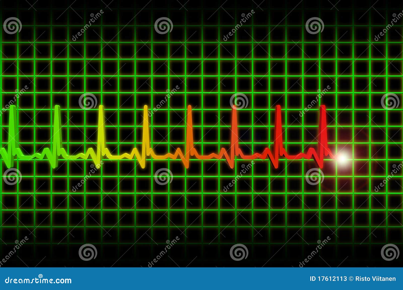 Ekg/ecg Pulse Diagram Header Stock Illustration - Illustration of ...