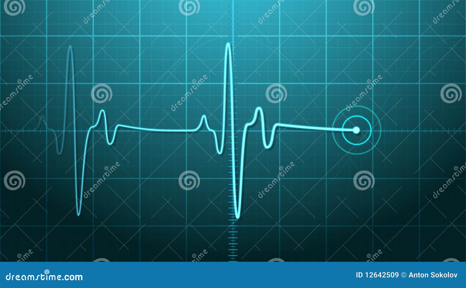 Electrocardiogram, Ecg, Ekg Royalty-Free Cartoon | CartoonDealer.com ...