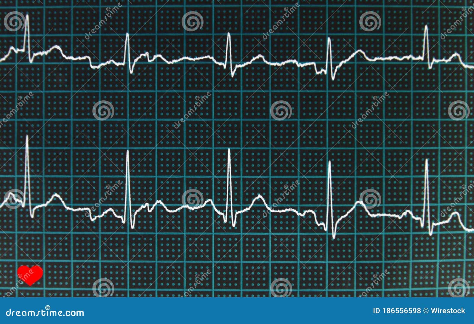 An EKG Electrocardiogram With Heart Pulse Stock Photography ...