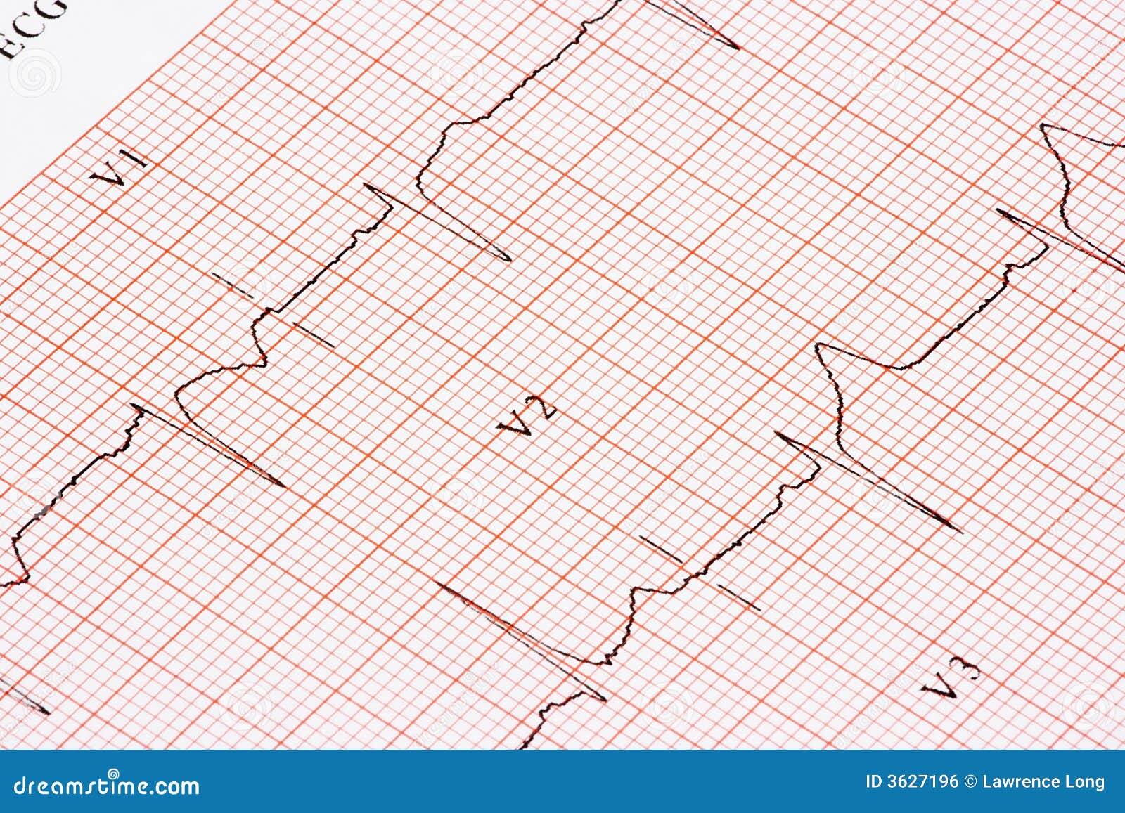 EKG graph stock photo. Image of pulse, beat, cardiac, measurement - 3627196
