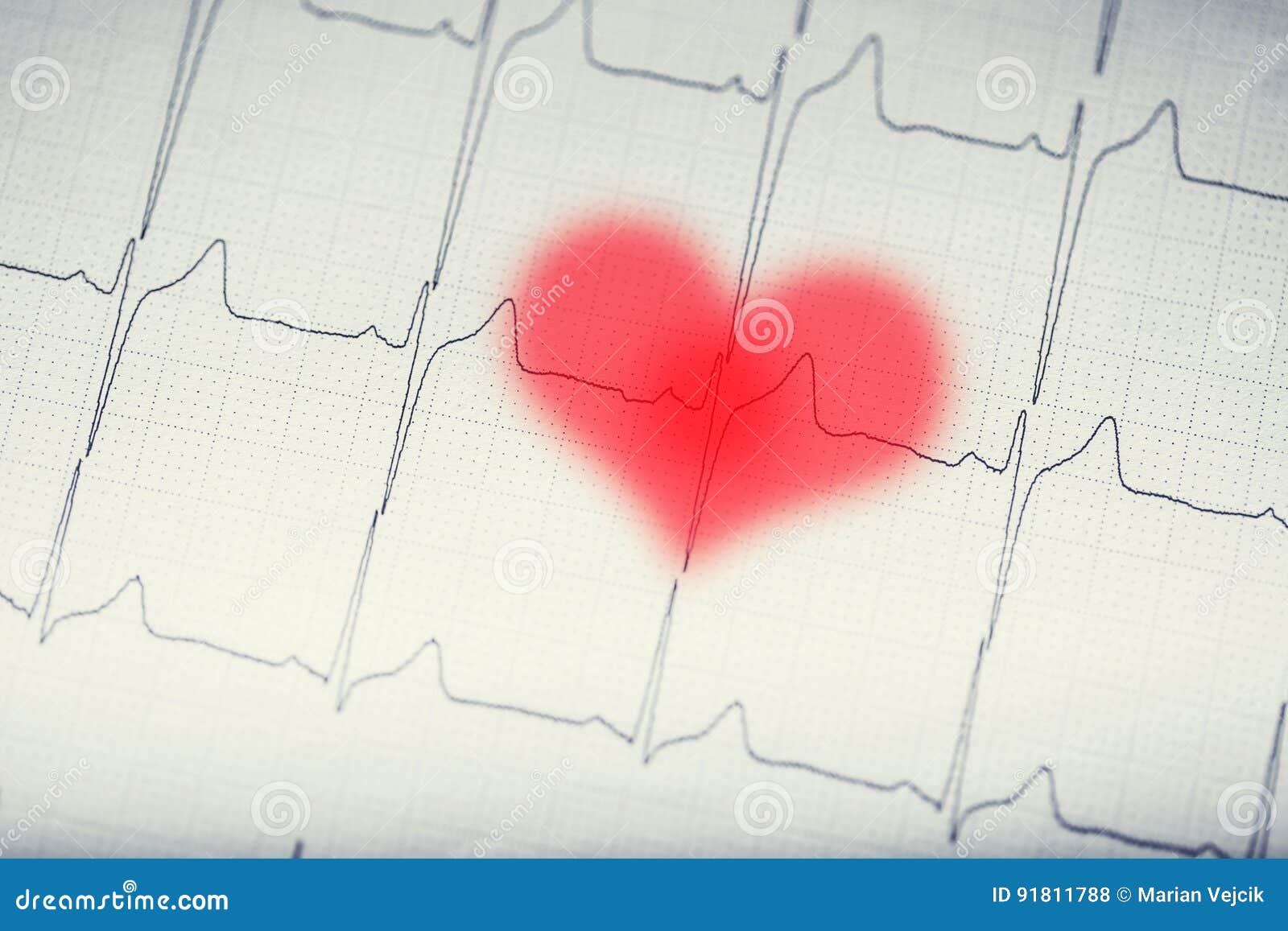 EKG, Ecg Graph, Electrocardiogram Ecg On Paper Stock Photography ...