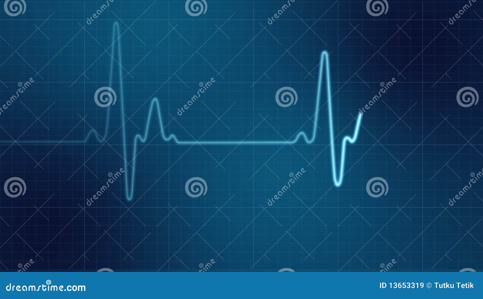 EKG Heart Monitor Stock Image | CartoonDealer.com #13653319
