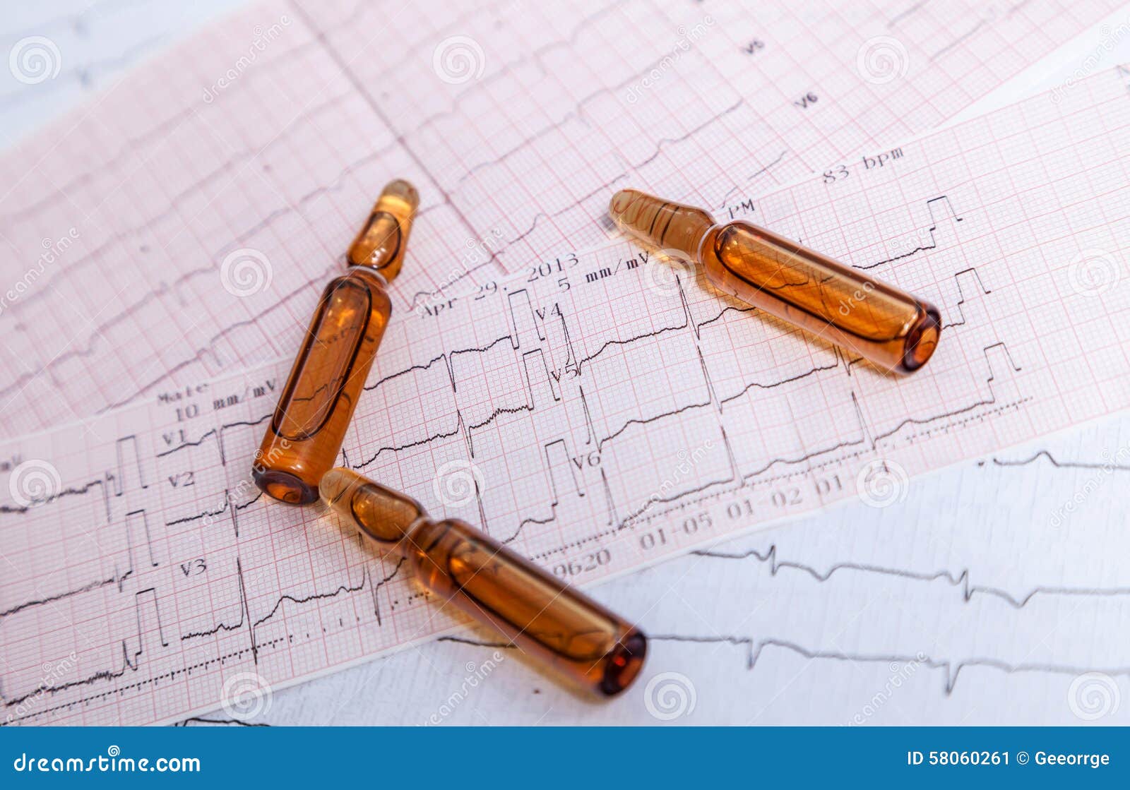 EKG heart rate control stock image. Image of electrocardiogram - 58060261