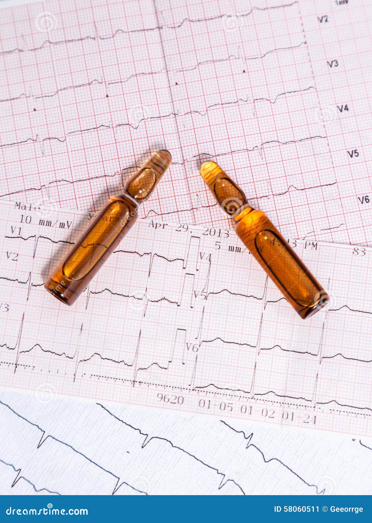 EKG heart rate control stock image. Image of cardiogram - 58060511