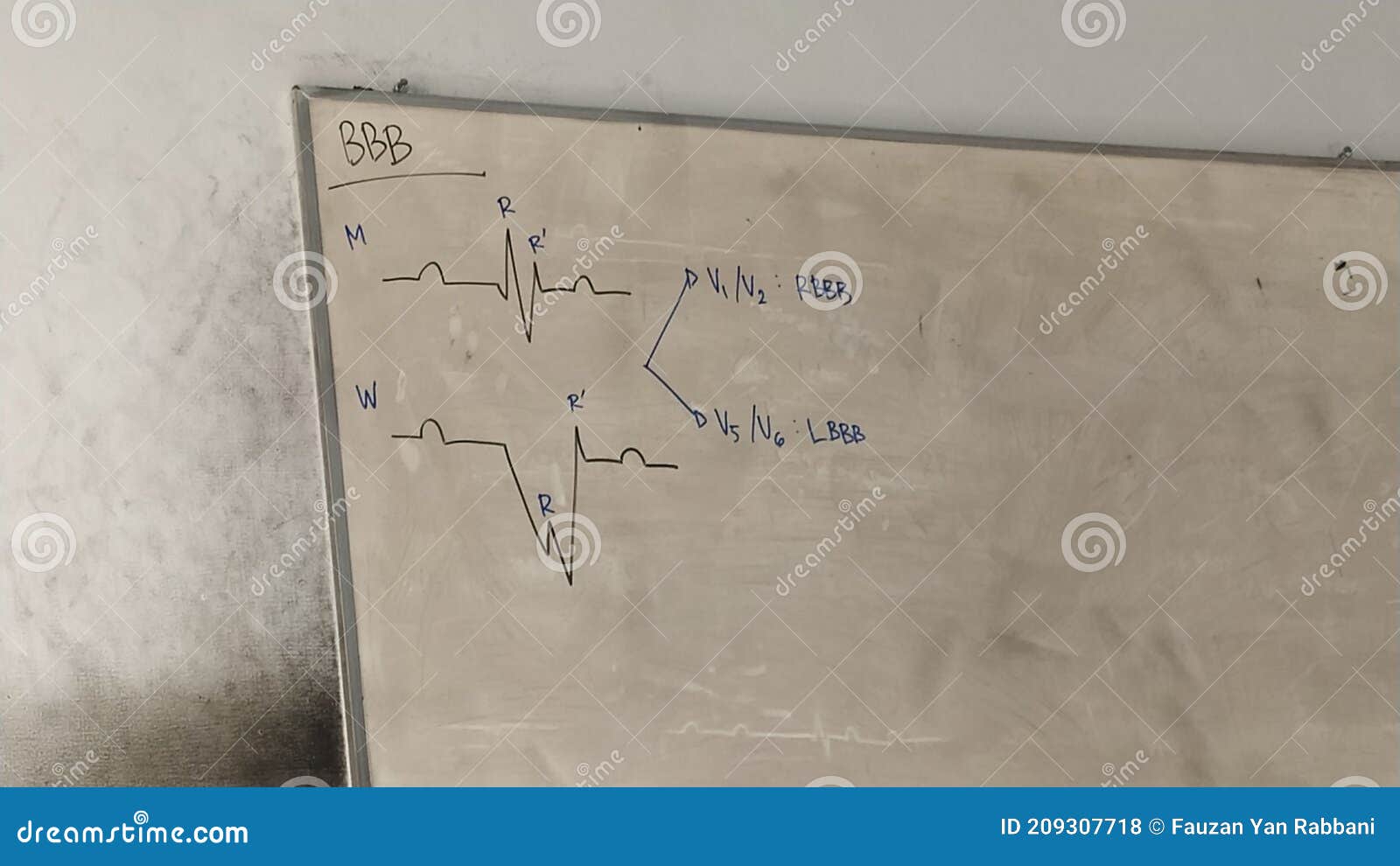 EKG lesson stock photo. Image of scribd, scribbles, whiteboard - 209307718