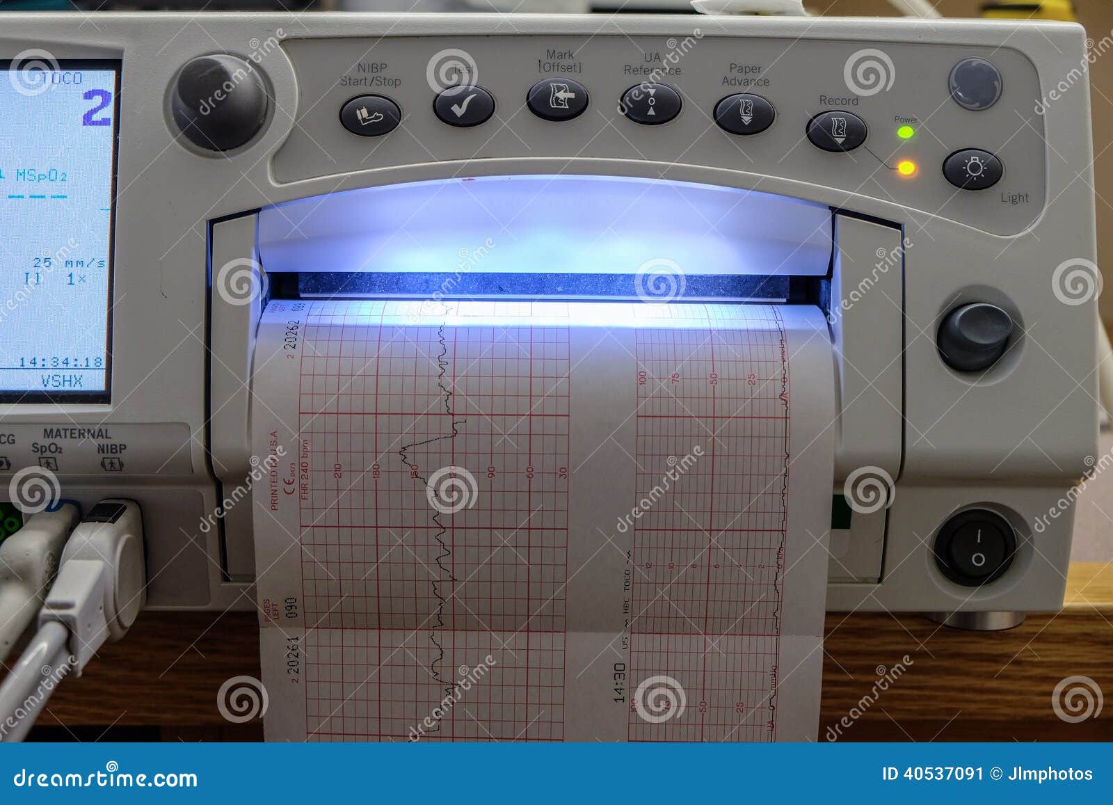 Ekg Buttons Photos - Free & Royalty-Free Stock Photos from Dreamstime