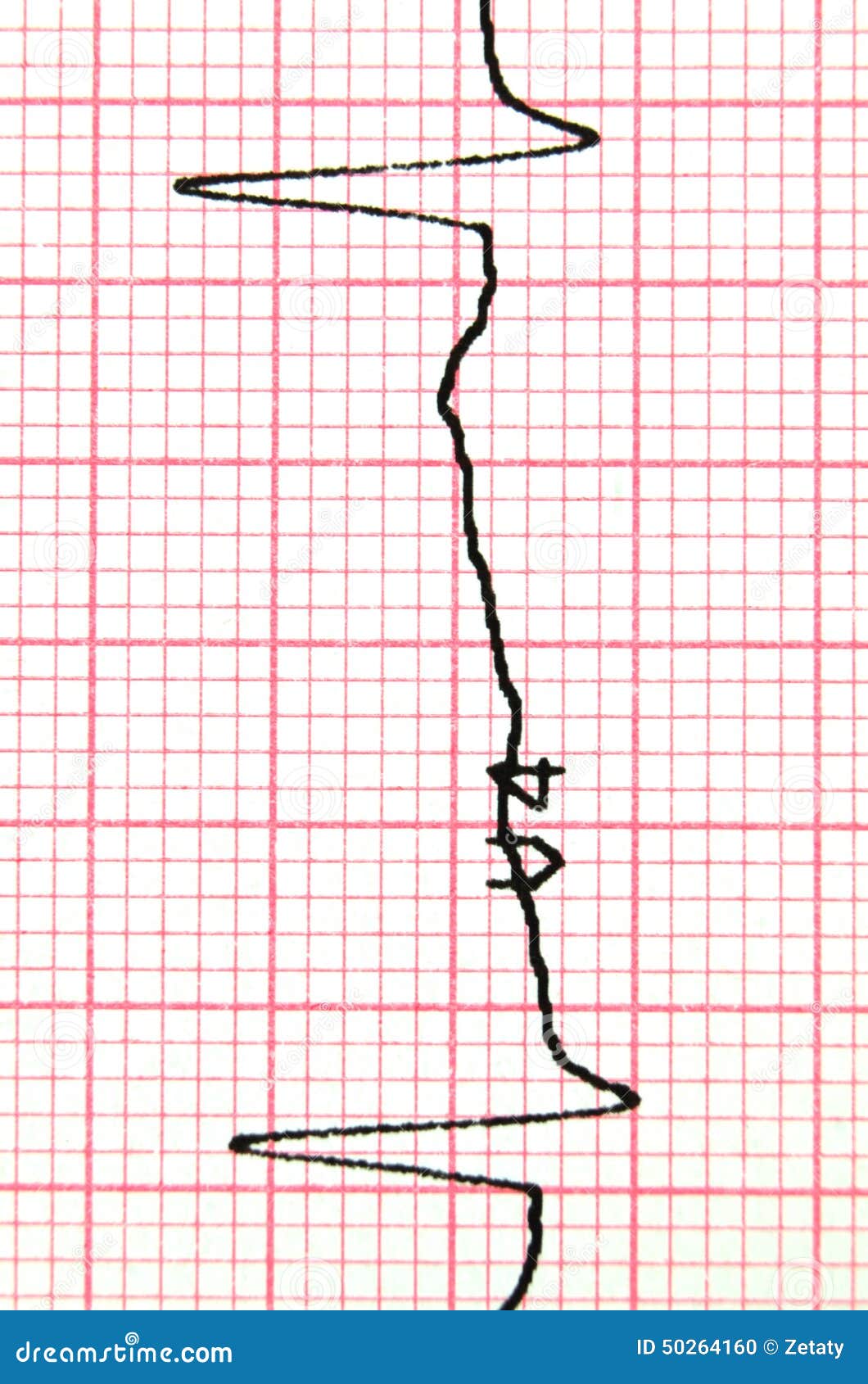 EKG stock illustration. Illustration of changing, analog - 50264160