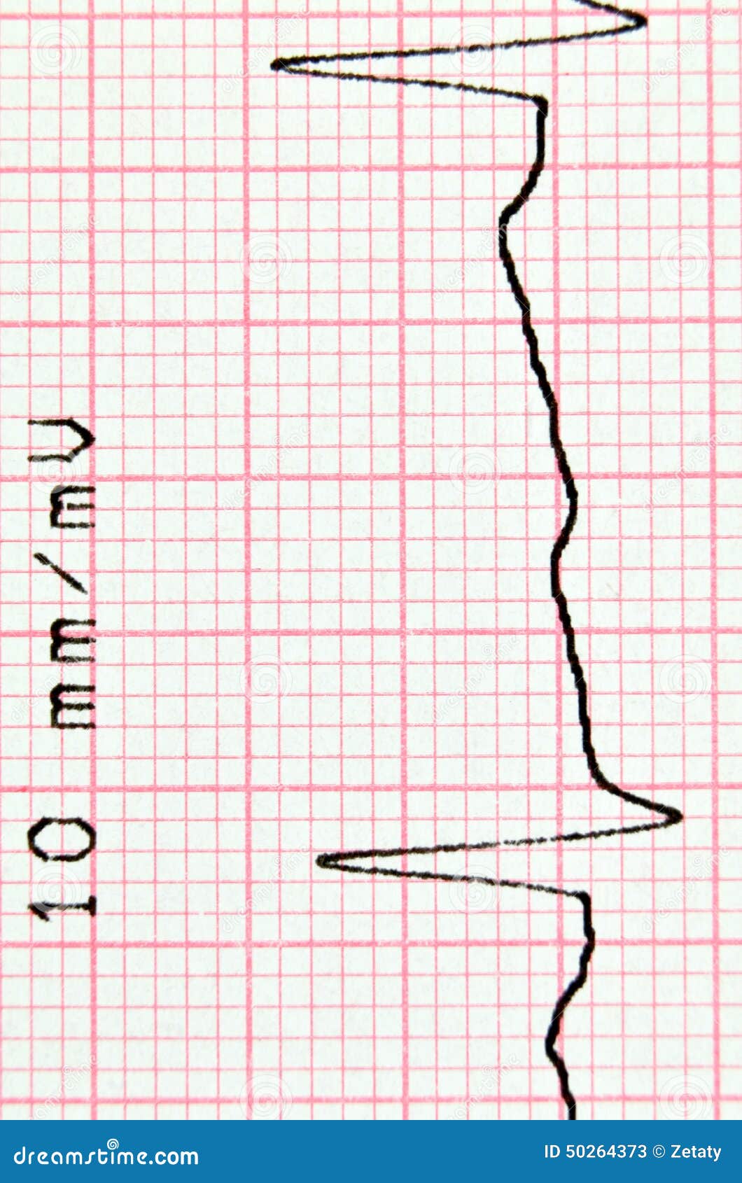 EKG stock illustration. Illustration of care, document - 50264373