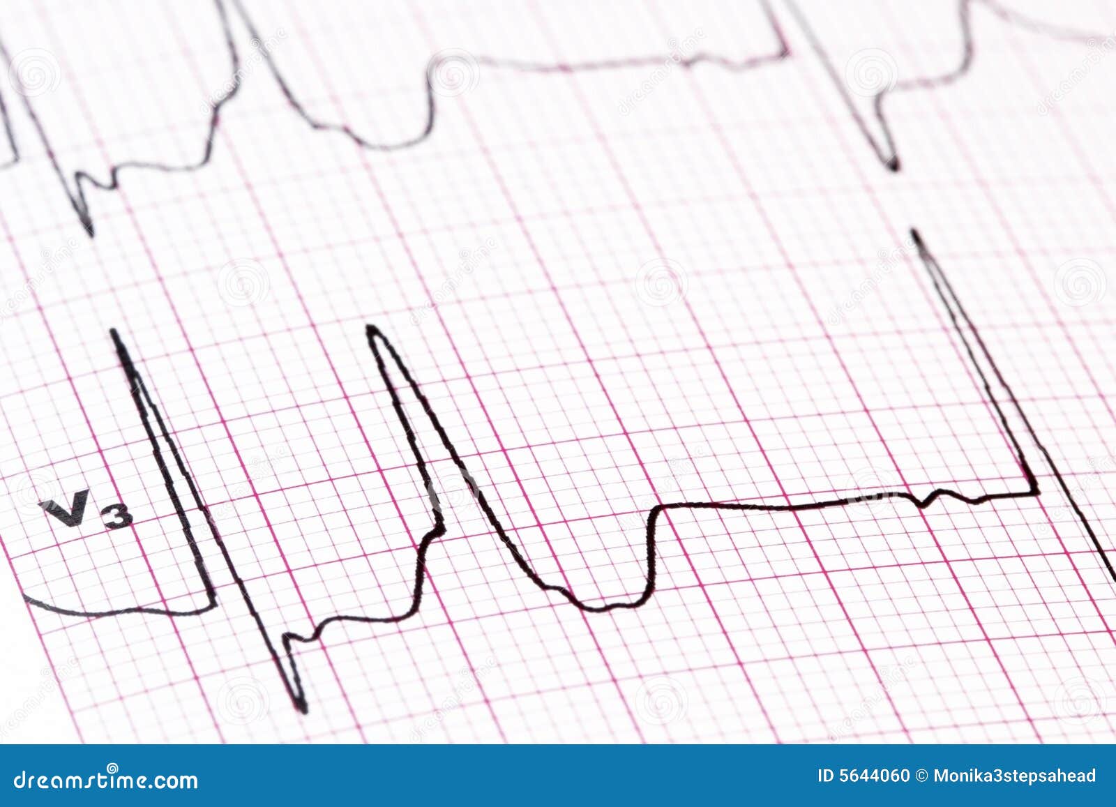 EKG - medical background stock photo. Image of electrical - 5644060