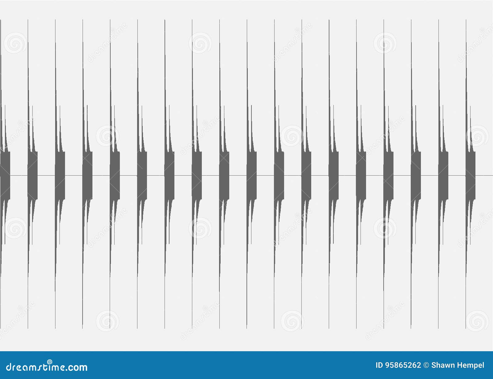 Royalty-Free EKG Medical Unit Beep Signal with Heart Beat Loop Stock ...