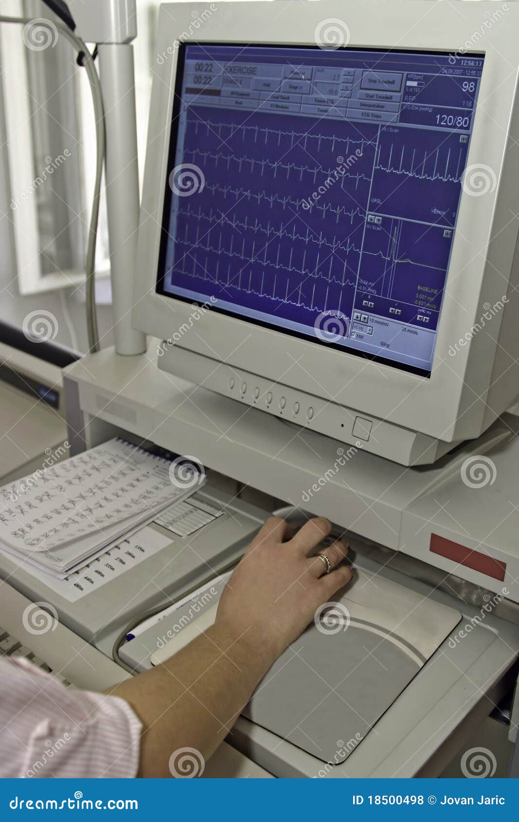 EKG monitor stock photo. Image of medical, doctor, frequency - 18500498